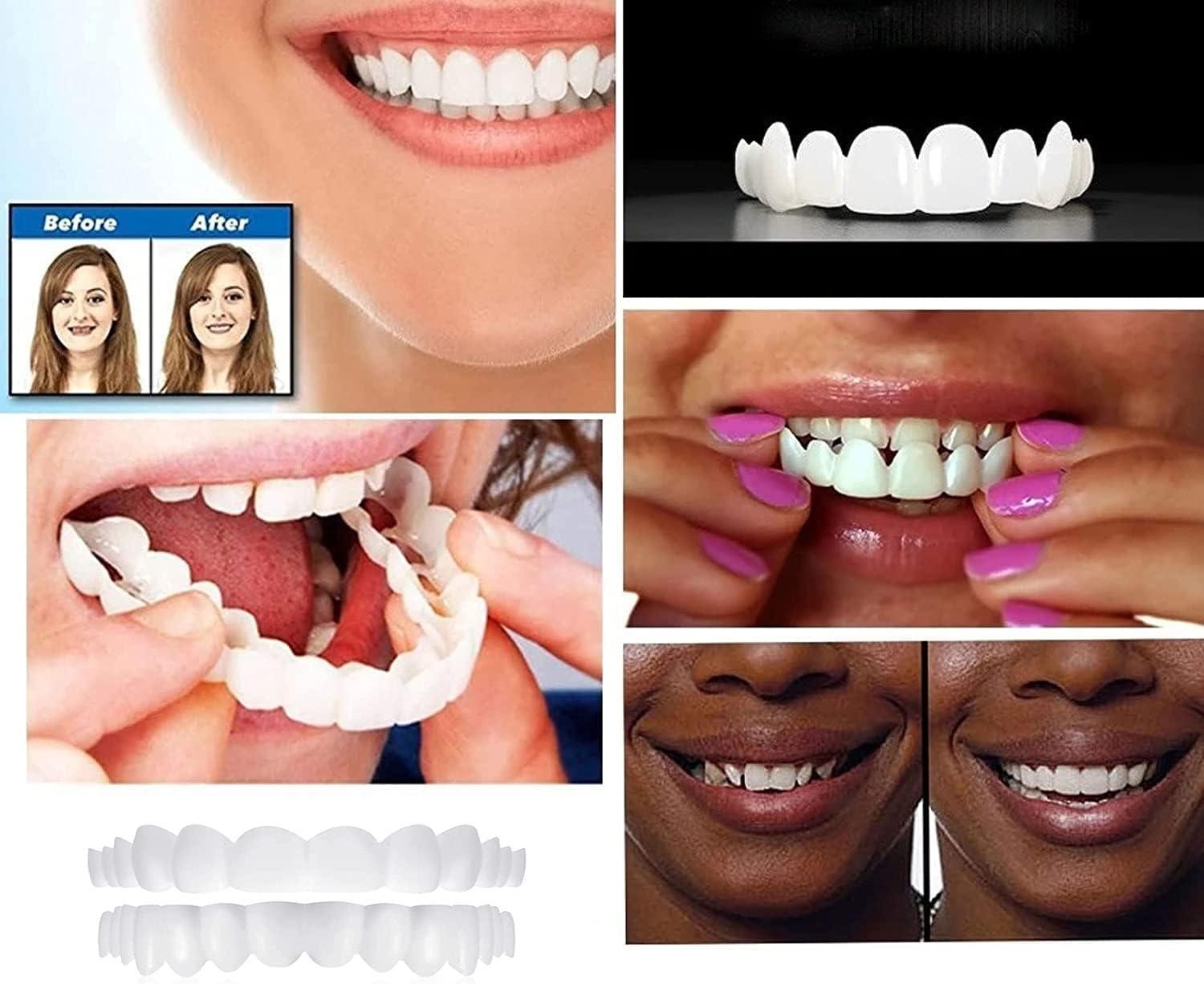 Brigtviee Dentures Teeth Set 2 Pairs Natural Cosmetic Veneers for ...