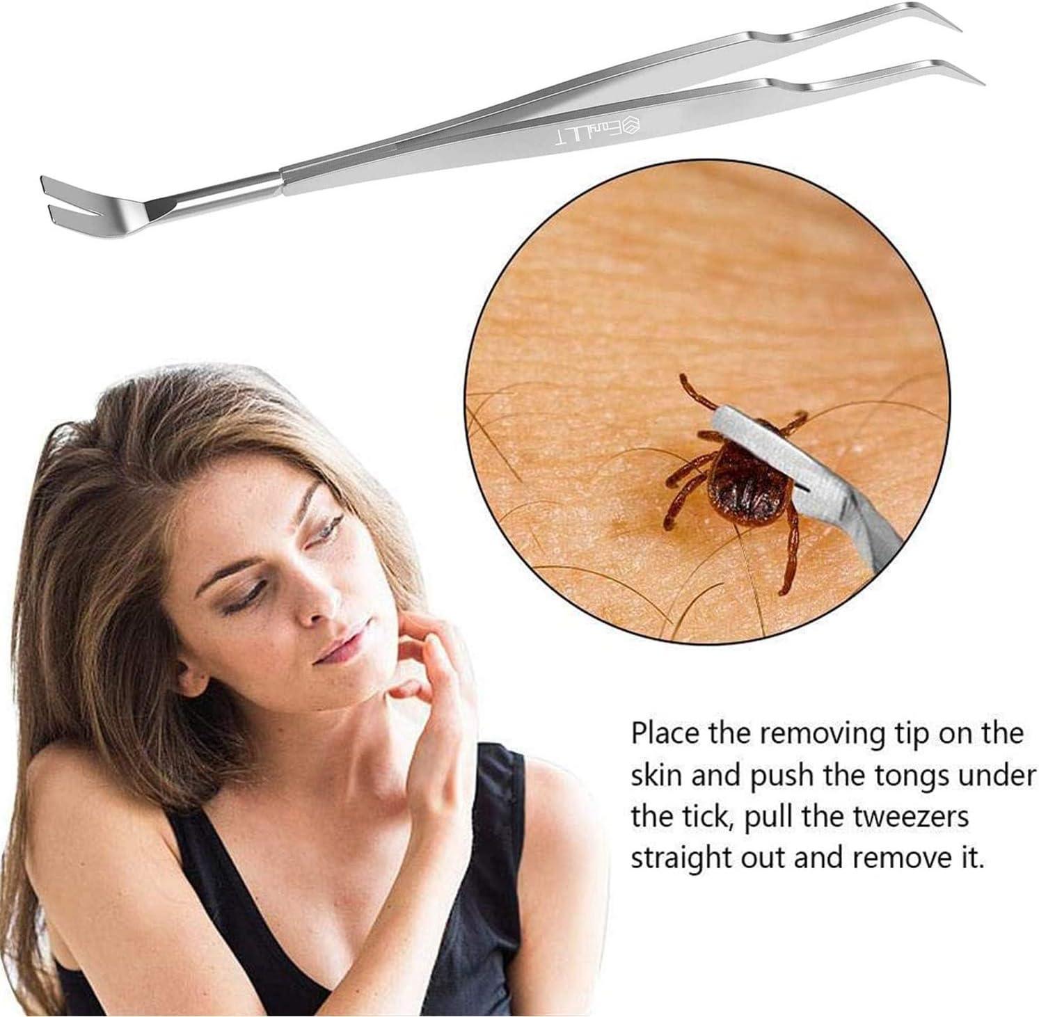 EasyULT Tick Remover Sided Stainless Steel Tick Remover with Storage ...