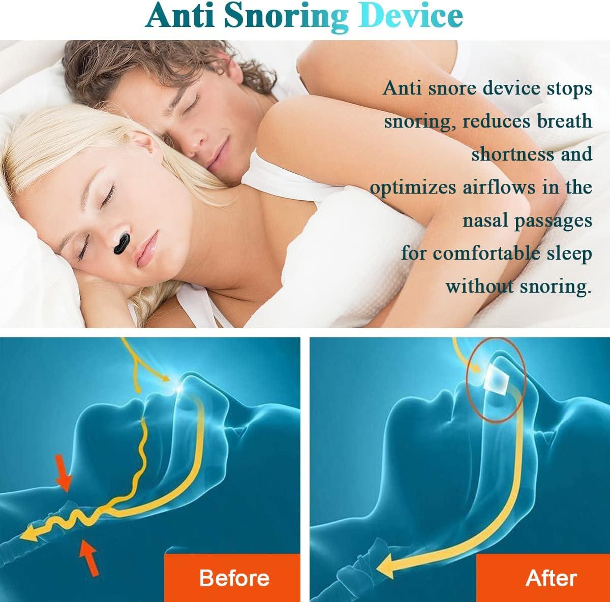 2-in-1 Anti Snoring Devices: Nose Air Purifier & Nasal Vents for Men ...