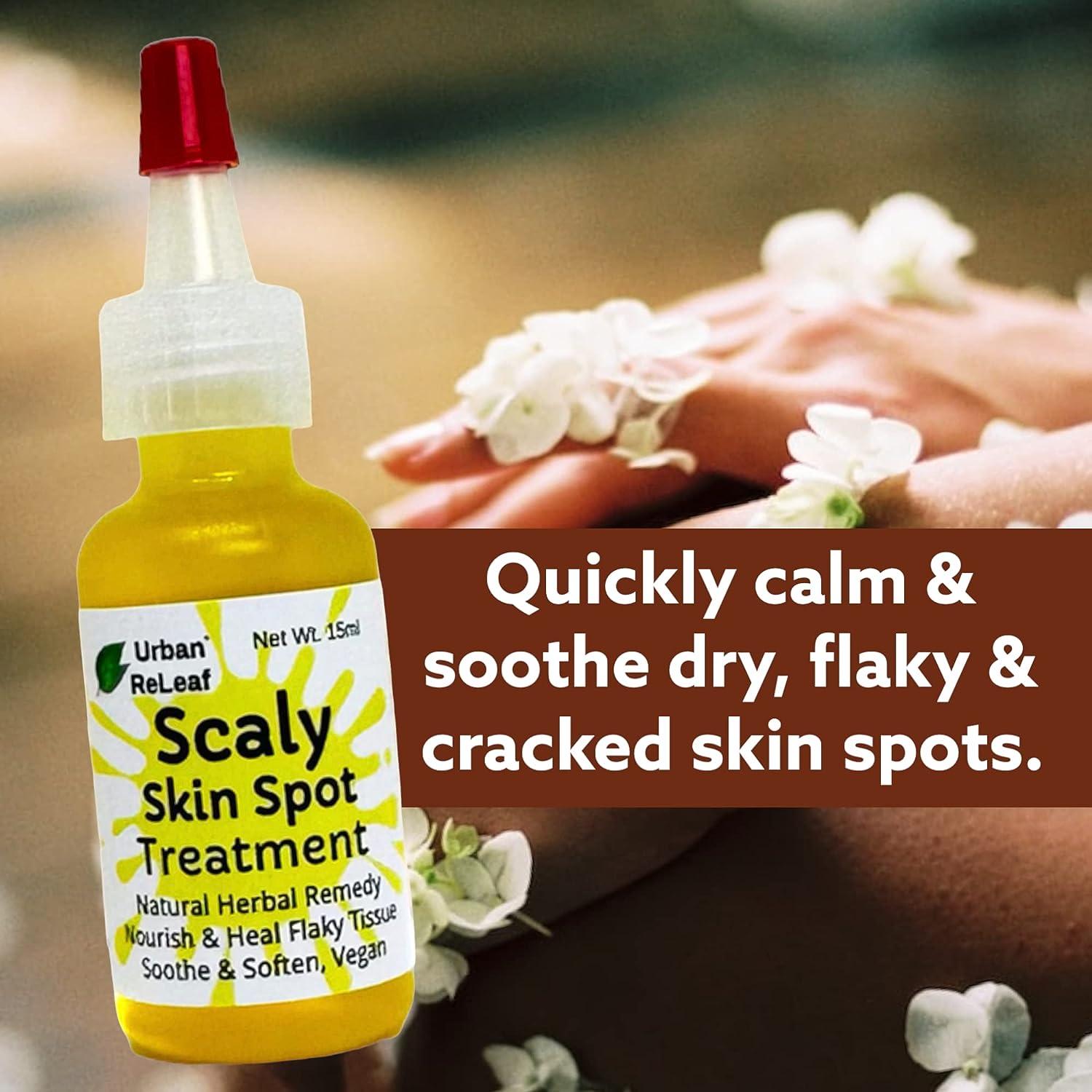 Urban ReLeaf Scaly Skin Spot Treatment - Natural Repair Oil for Flaky ...