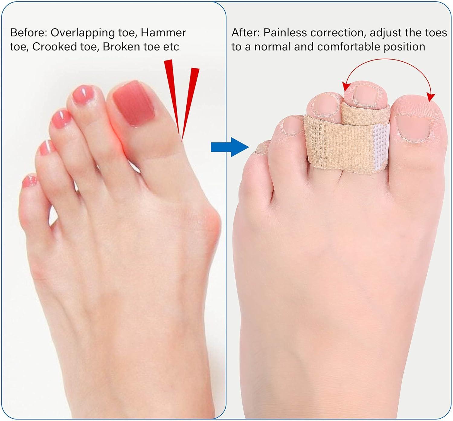 DYKOOK Broken Toe Wraps 8 Pcs Fabric Splint Cushioned Bandages for Toe ...