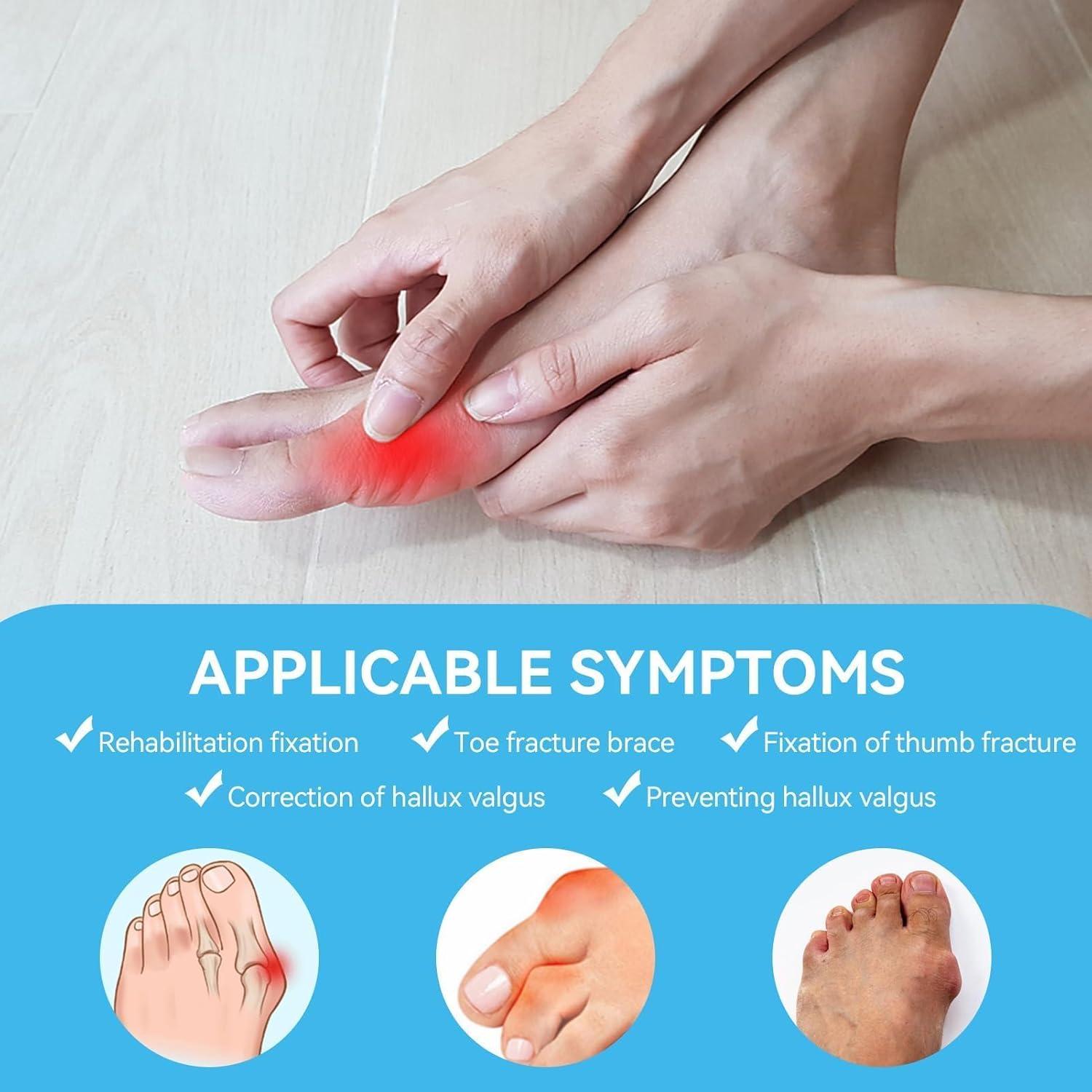 Agate Toe Clasp for Hallux Valgus - Toe Straightener & Injury Support ...