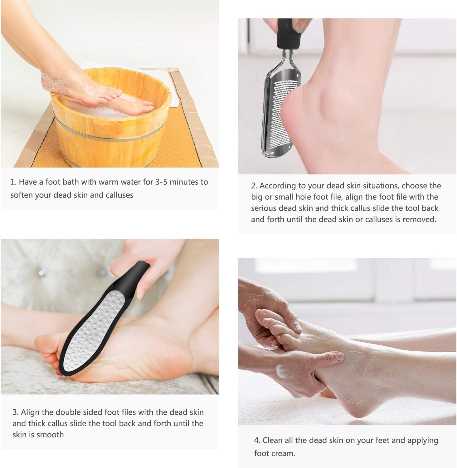 ERGOfoot 3 PCS Professional Foot Rasp Set for Wet/Dry Feet - Callus ...