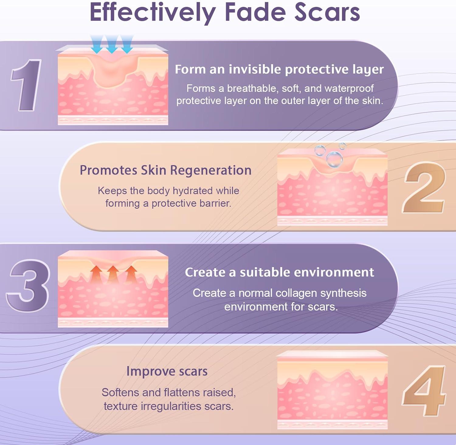 Silicone Scar Sheets Roll 1.6x120 - Ultra-Thin & Soft Medical Grade ...