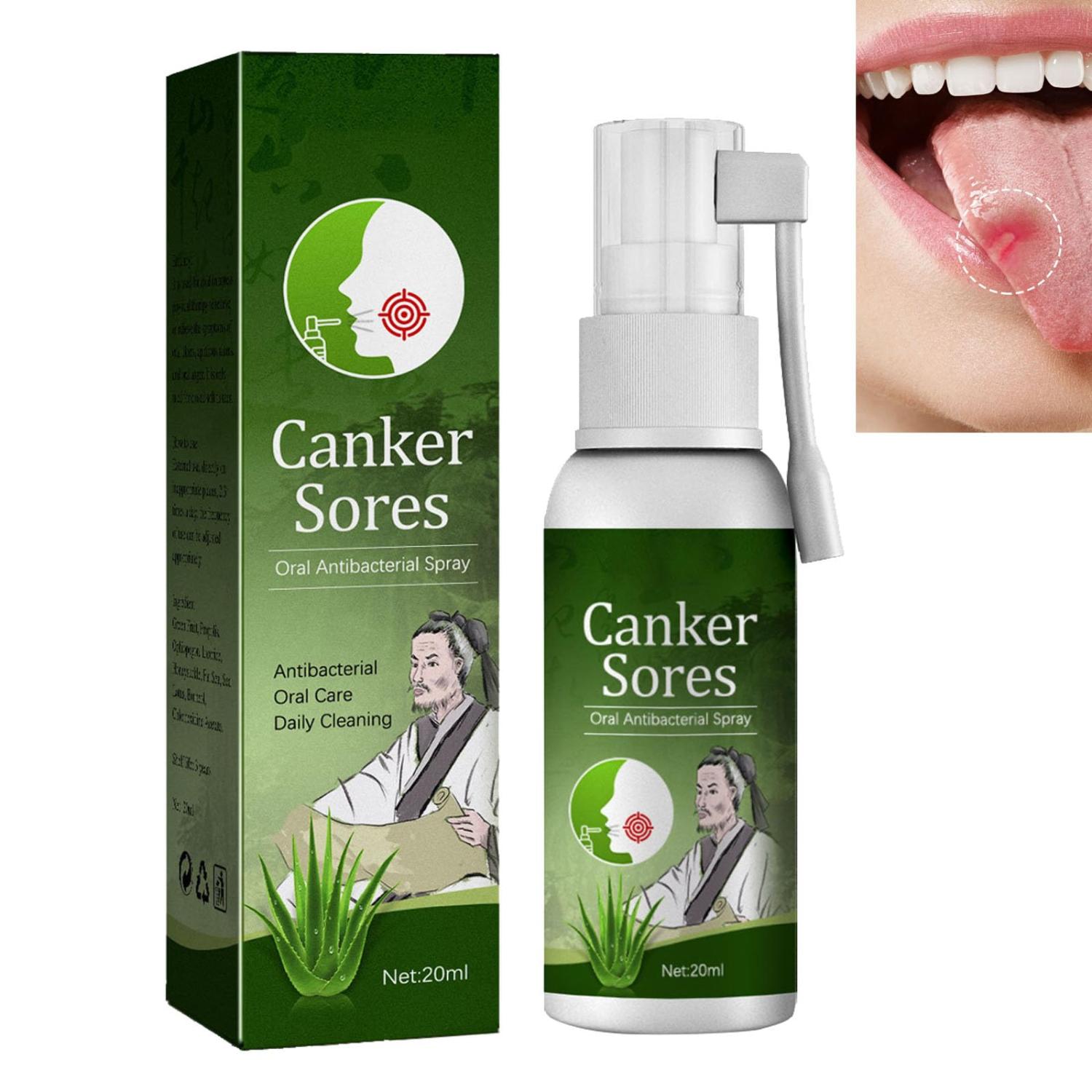 Oral Ulcer Relief Spray 20ml - Canker Sore & Gum Pain Relief Treatment ...