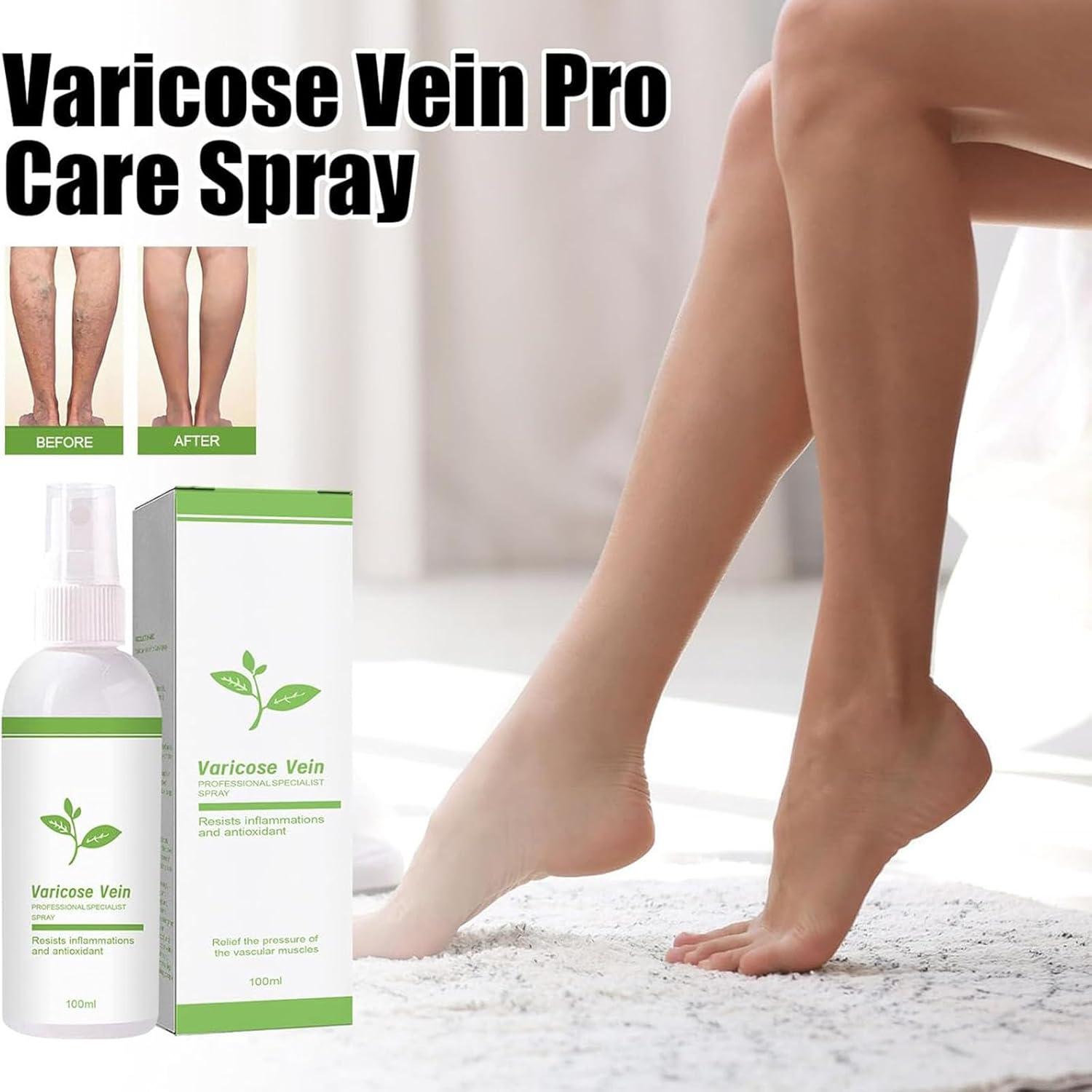 Varicose Veins Expert Spray - Effective Treatment for Legs Boost Blood ...