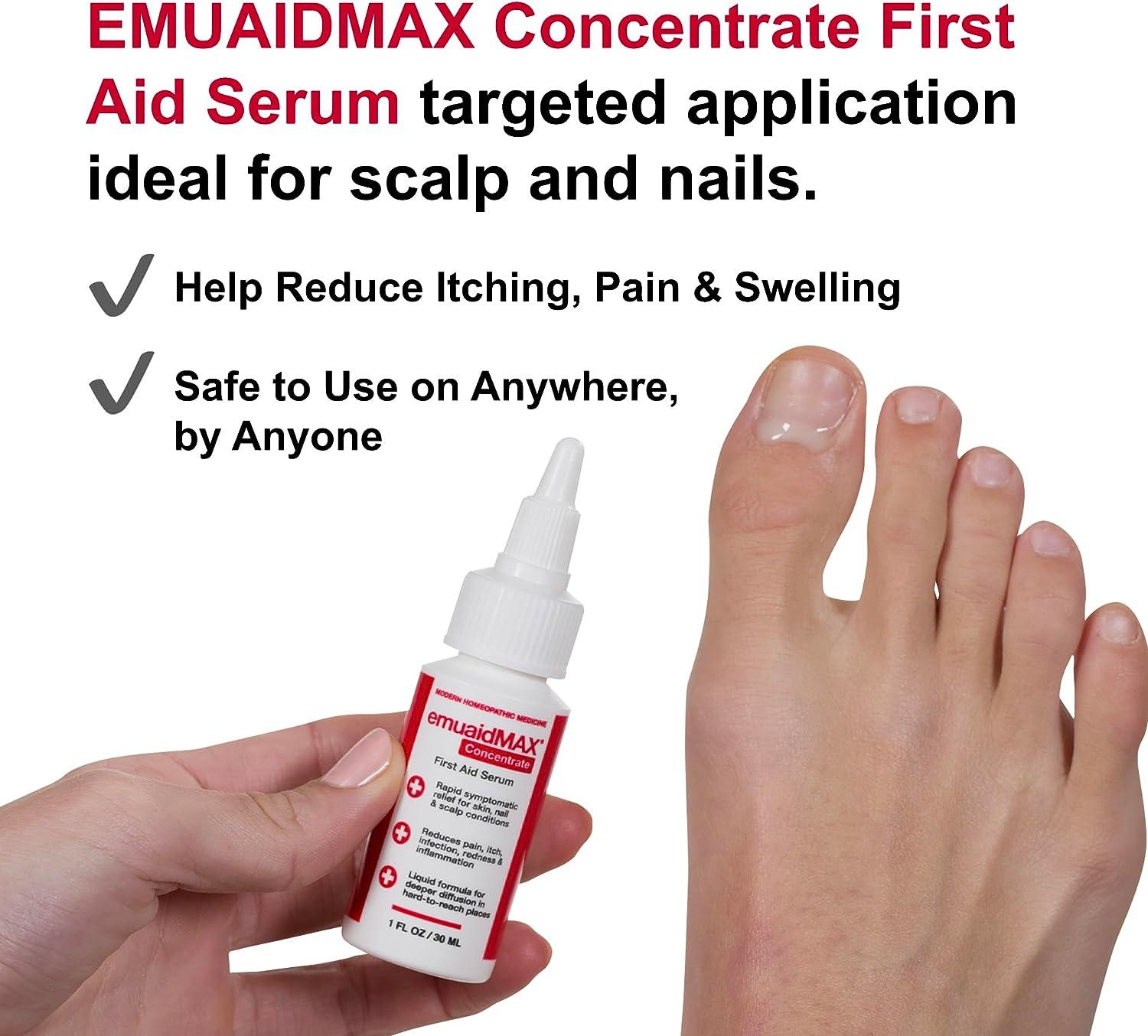 EMUAIDMAX Concentrate 1oz: First Aid Serum for Psoriasis, Eczema, Nail ...
