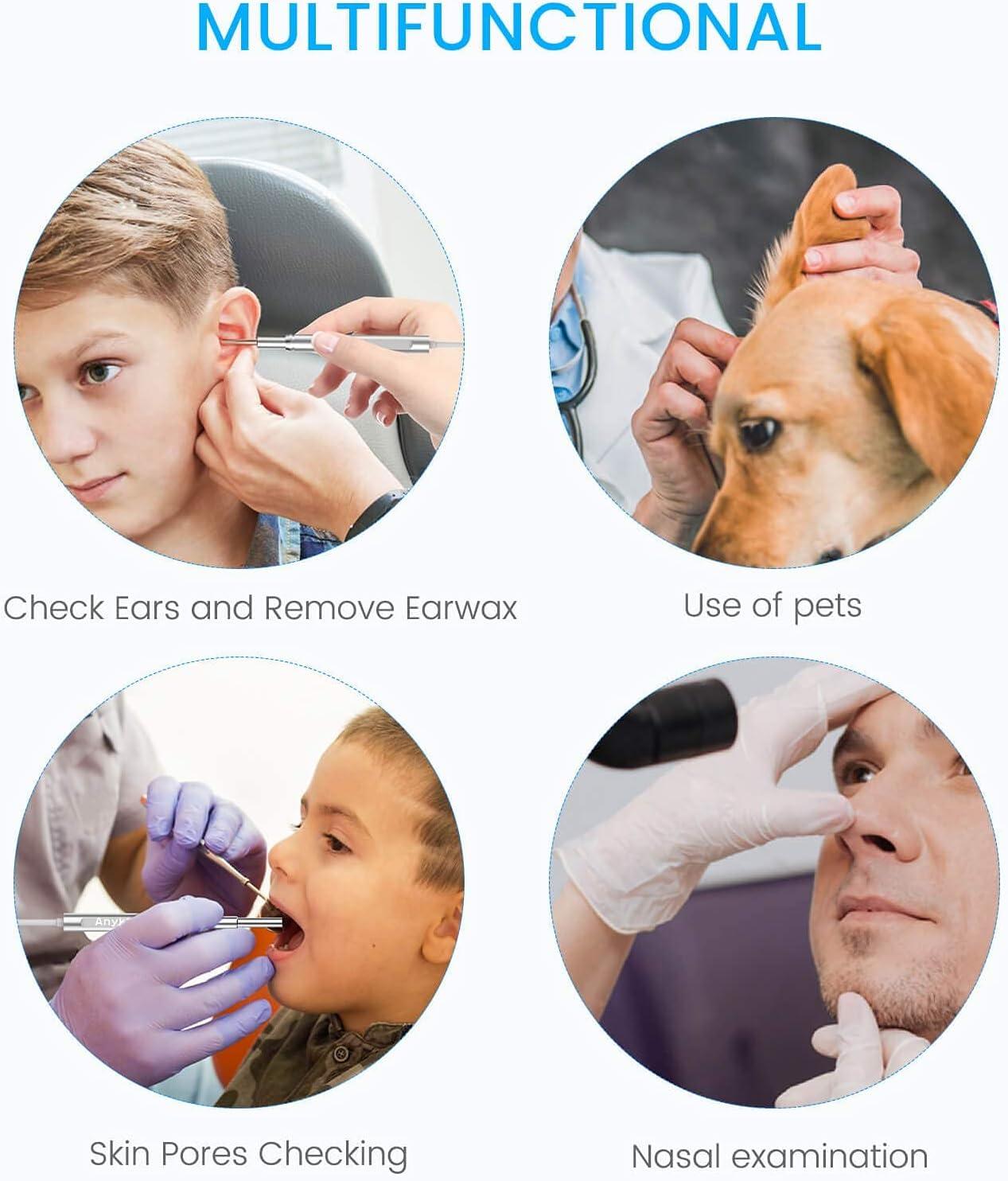 Otoscope View Ear Wax