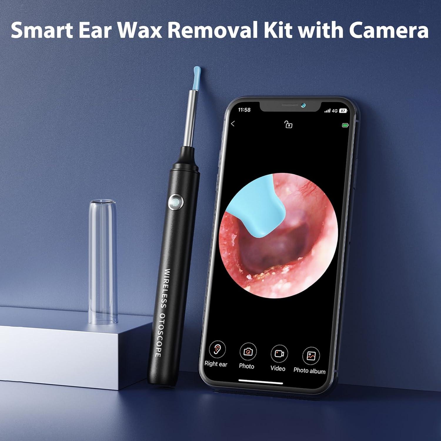 Hopefox 1080P Ear Wax Removal Kit Camera with WiFi, Otoscope & Ear Pick ...