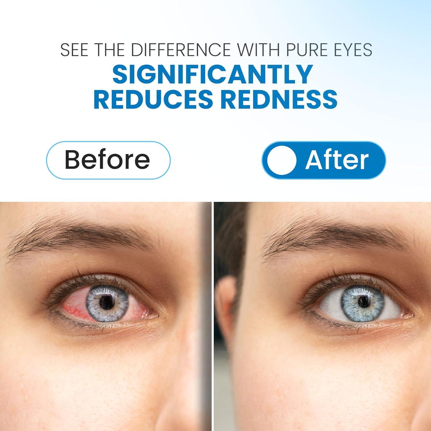 Buy Pure Eyes Redness Relief Eye Drops - Lubricating & Moisturizing ...