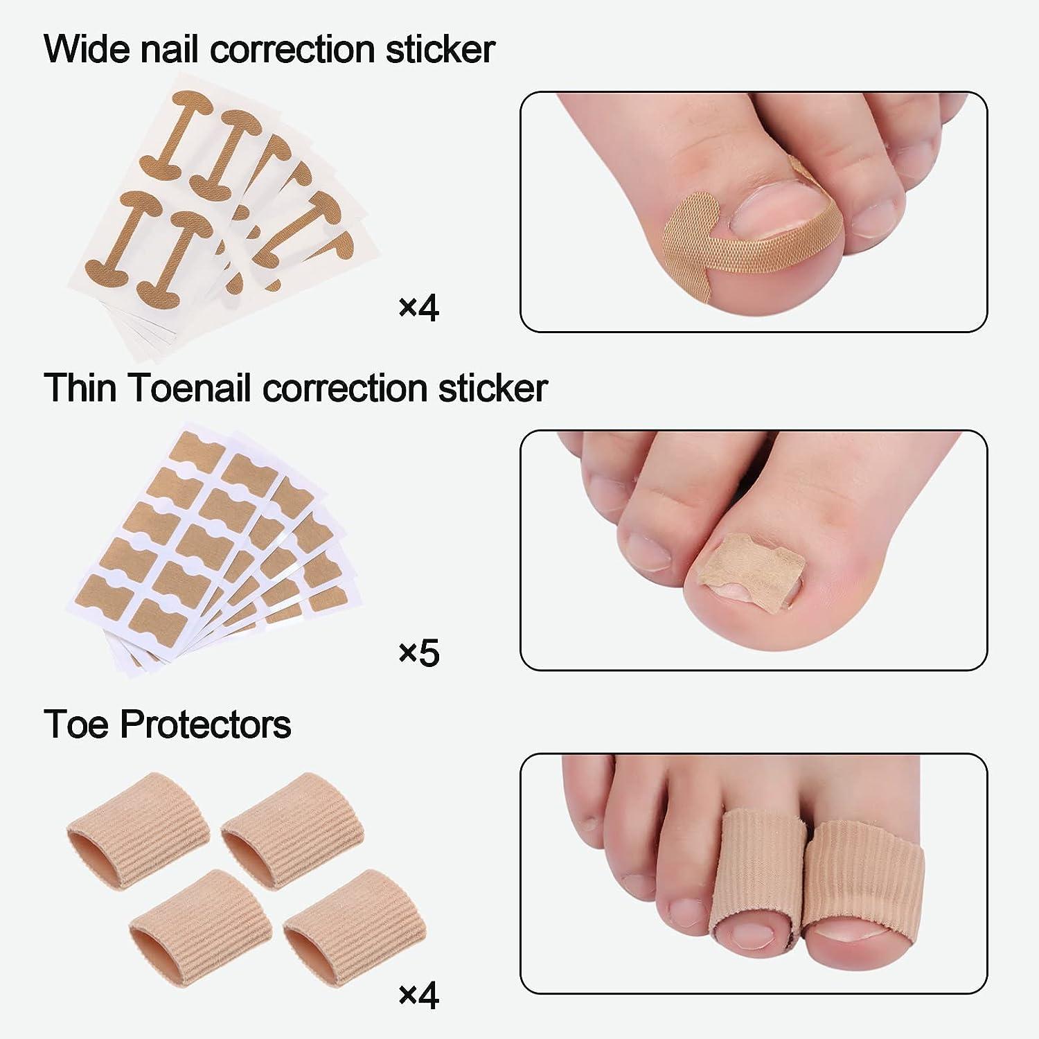 Ingrown Toenail Treatment Kit | Toe Nail Correction Tool Set with ...