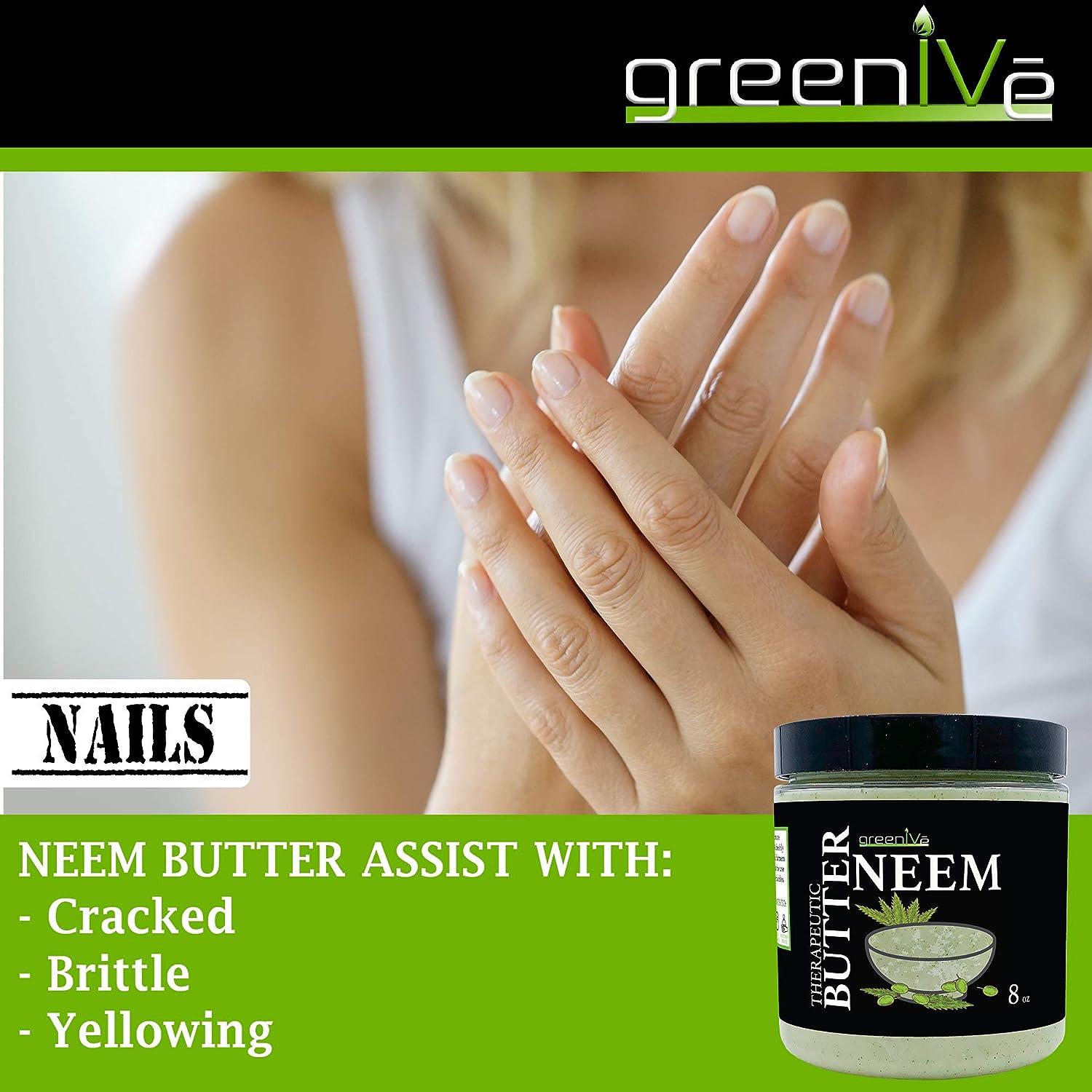 GreenIVe Neem Body Butter - Soothing & Moisturizing 8 oz - All Natural ...