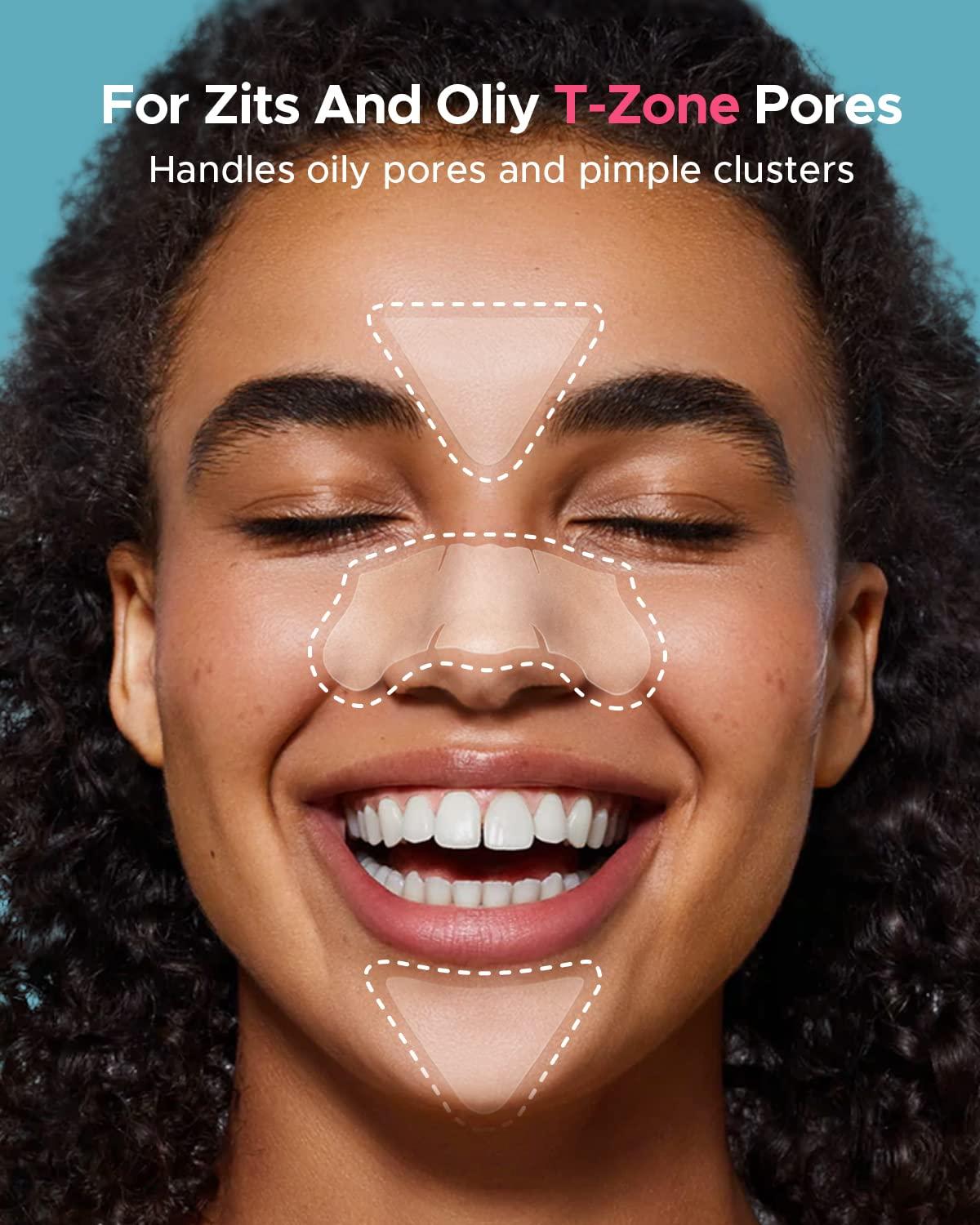 LitBear XL T-Zone Patch - 30 Patches, Hydrocolloid for Nose, Forehead ...