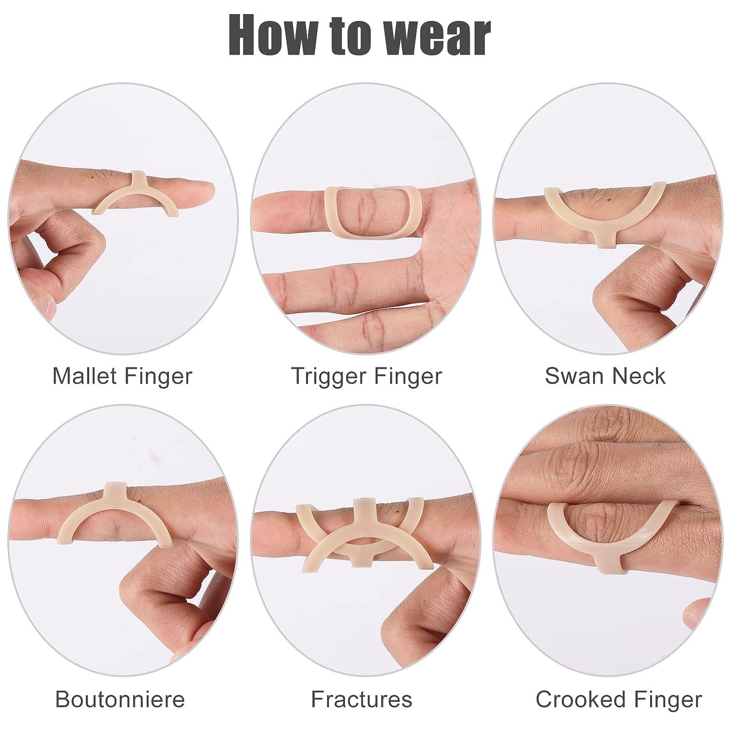 LUTER 3pcs Oval Finger Splint Set for Trigger Finger - Sizes 6.2-6.8cm ...
