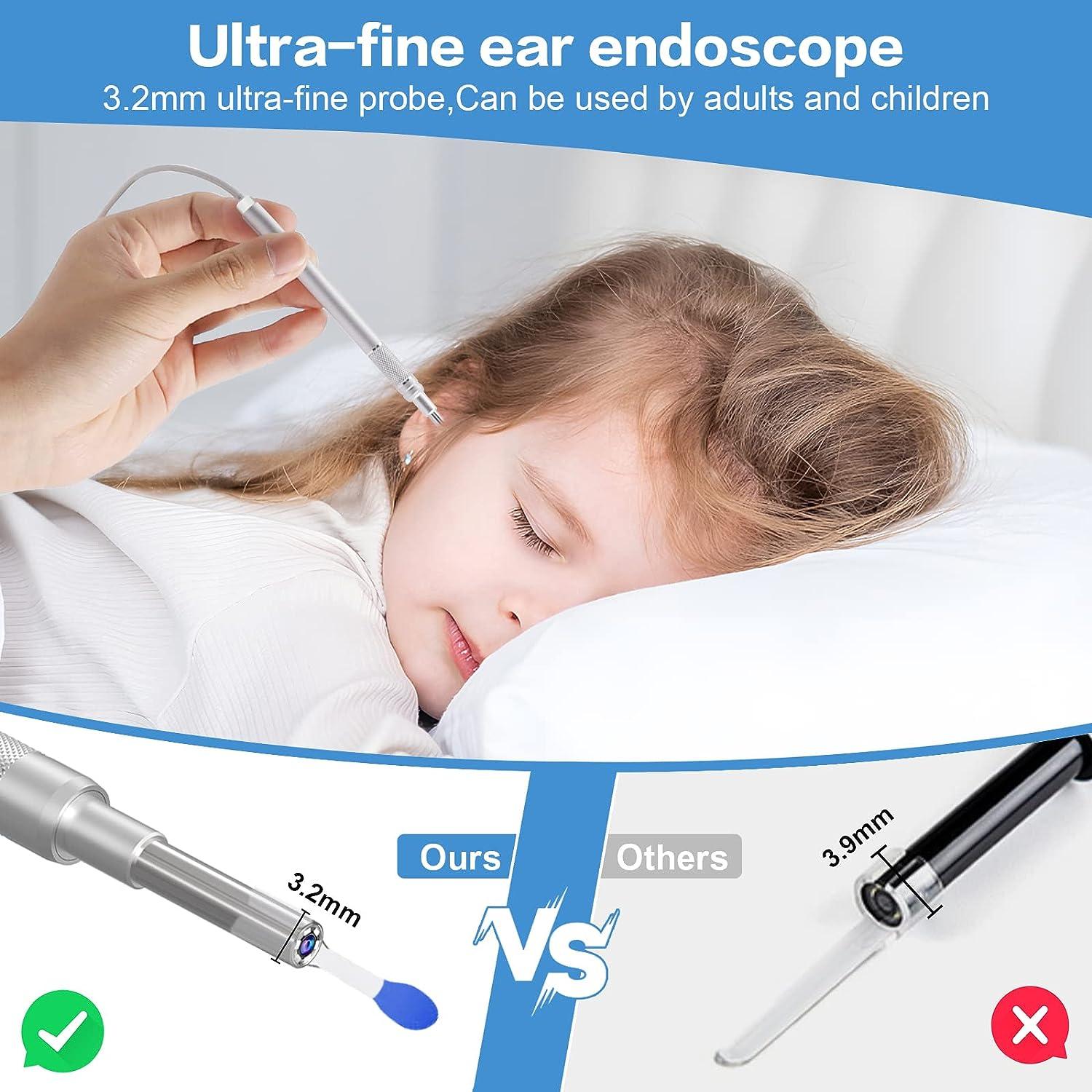 AI Intelligent Visual Digital Otoscope Hiacinto | Ear Wax Removal Tool ...