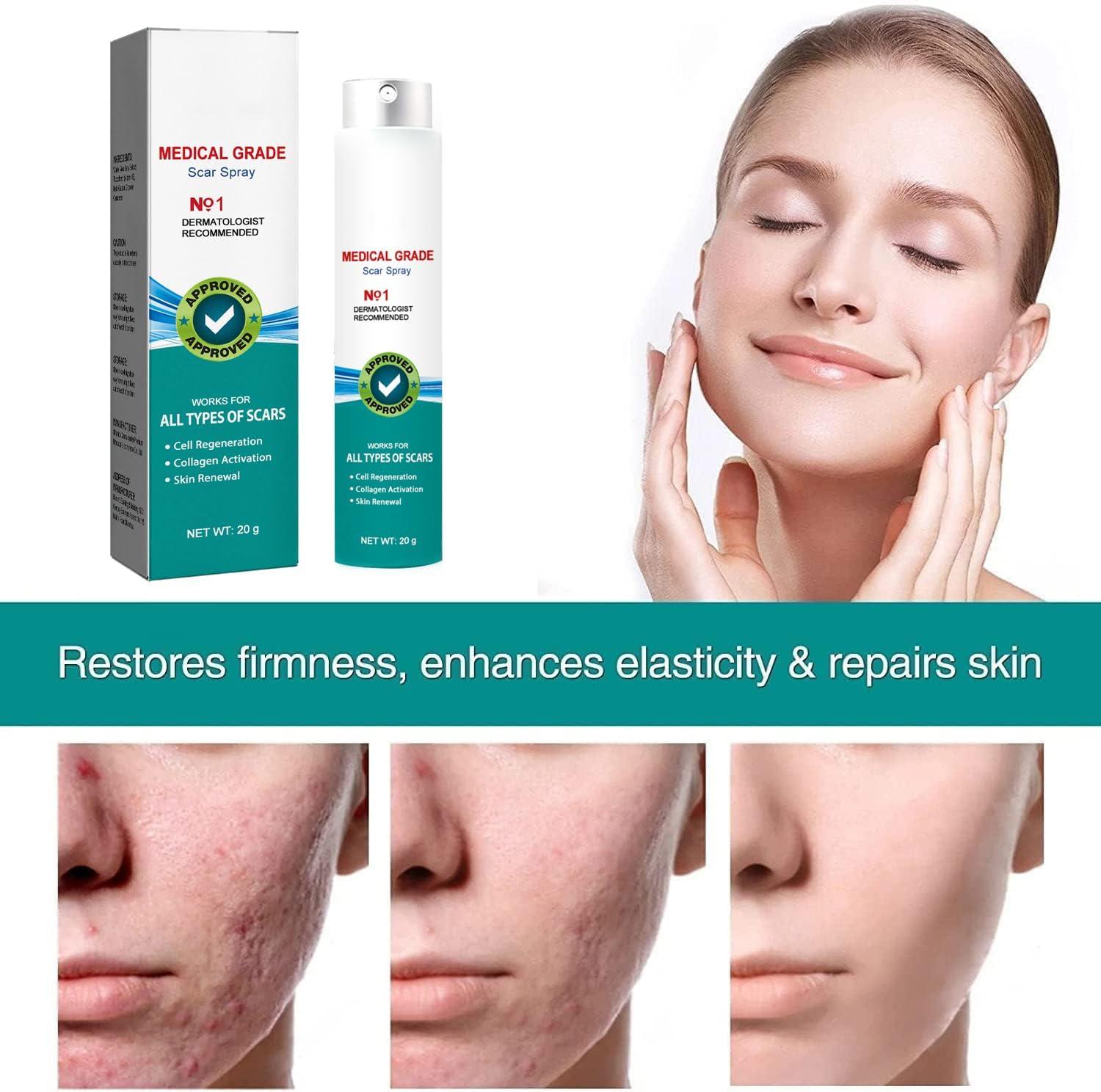 Scar Removal Advanced Spray - 2PCS (20g) | Remove Dark Acne, Surgical ...