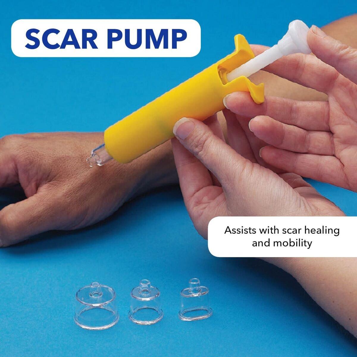 Rolyan Scar Pump: Suction Pump for Lesion Healing, Tendon Repair, and ...