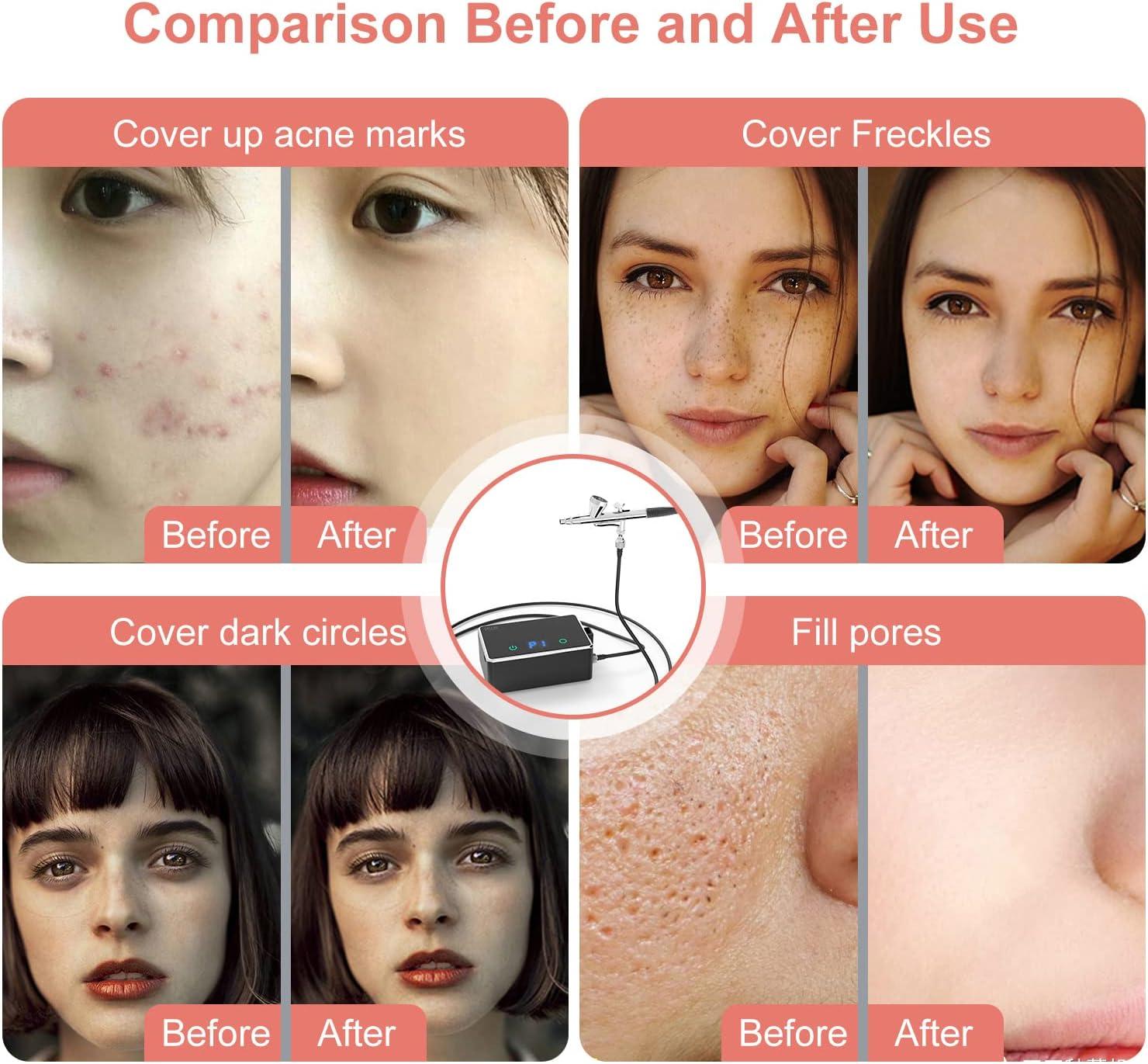 Airbrush Makeup Acne Before And After | Saubhaya Makeup