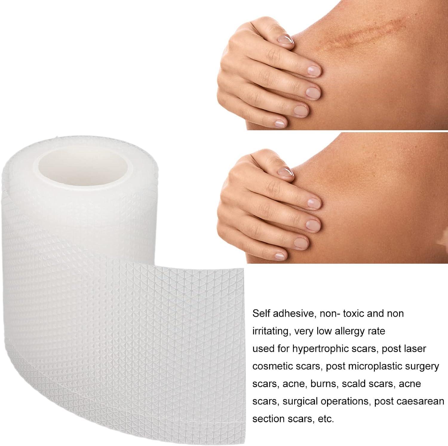 Silicone Scar Sheets - Surgical and Caesarean Scar Removal Tape for Men ...