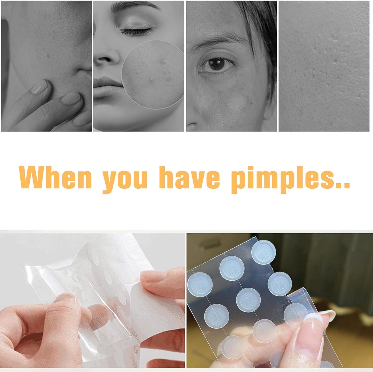 LacyMC Acne Patches - 60 Pack, 8mm & 12mm Hydrocolloid Dressing for ...