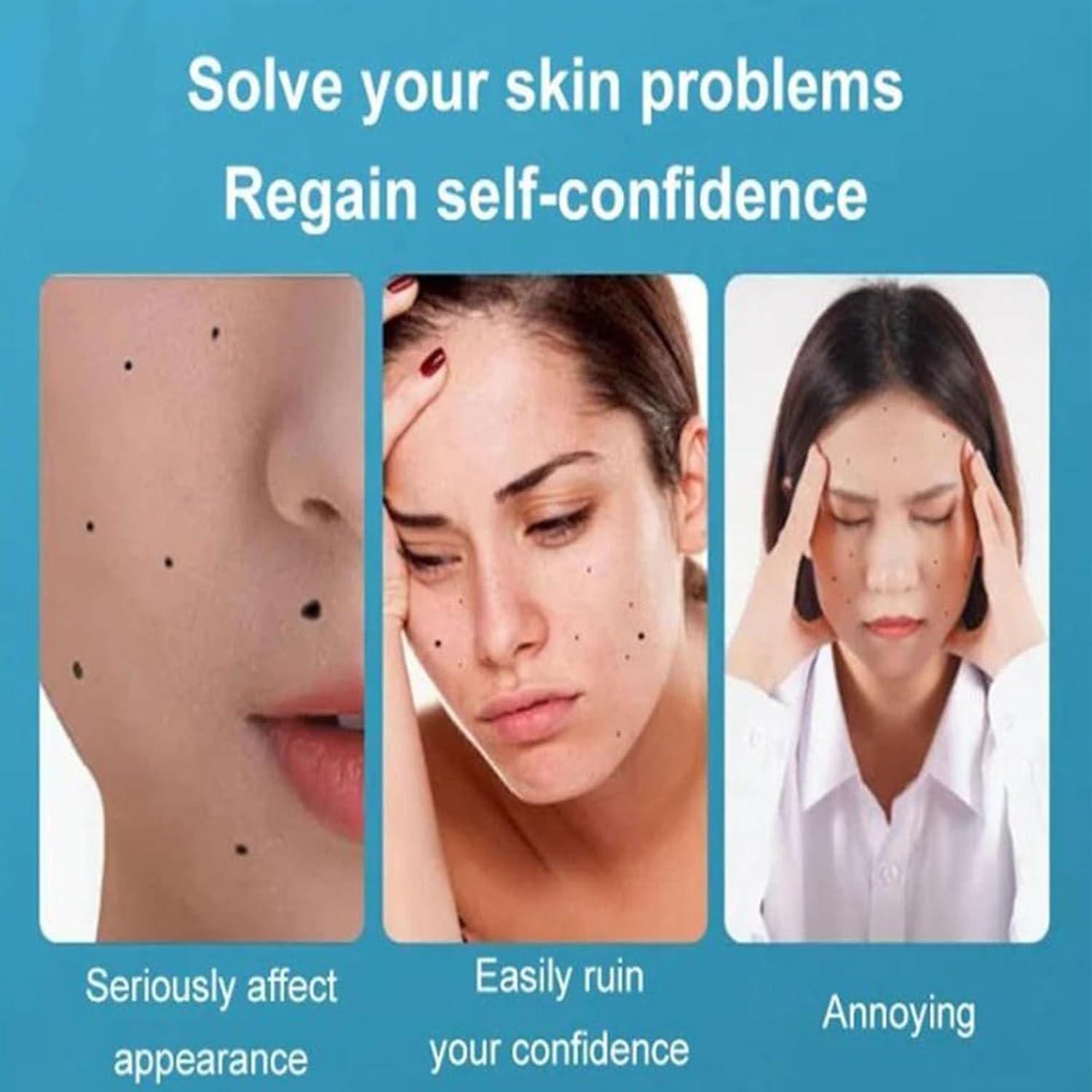 REATIFUL Concentrated Skin Removal Cream - Herbal Formula Ointment for ...