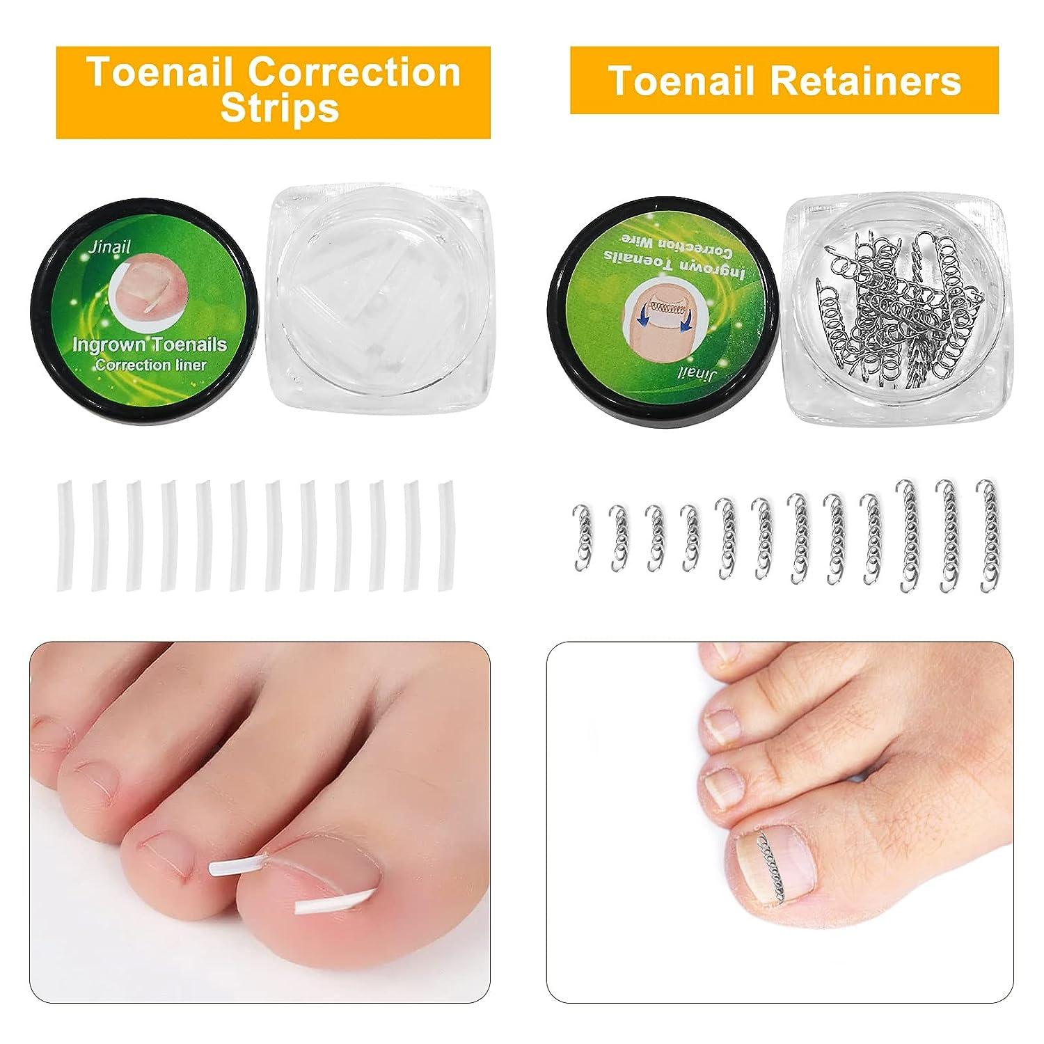 Professional Ingrown Toenail Removal Kit - 92 PCS Treatment Tool for ...