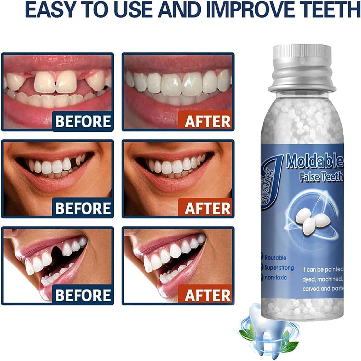 DIY Moldable False Teeth Repair Kit - Instant Tooth Filling Replacement ...