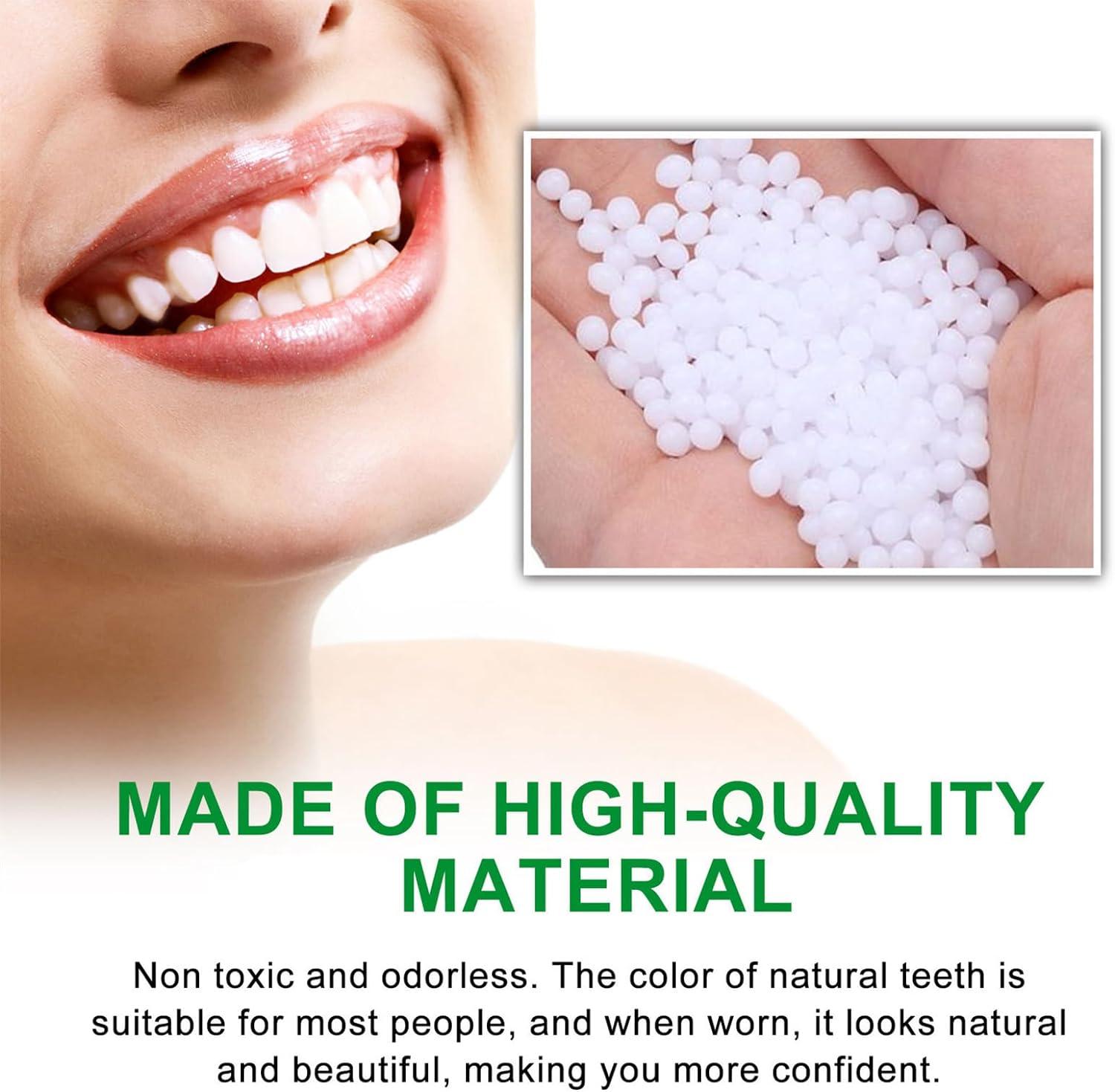 Temporary Tooth Filling Kit - 2 * 30ml Moldable Fake Teeth Filling ...