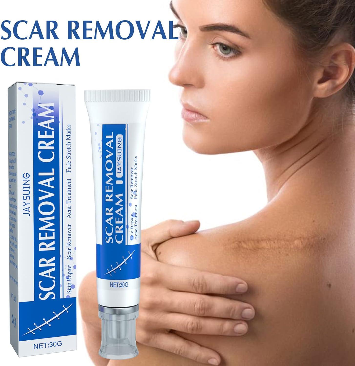 Skin Scar Repair Solution for All Skin Types - Gentle Scar Removal ...