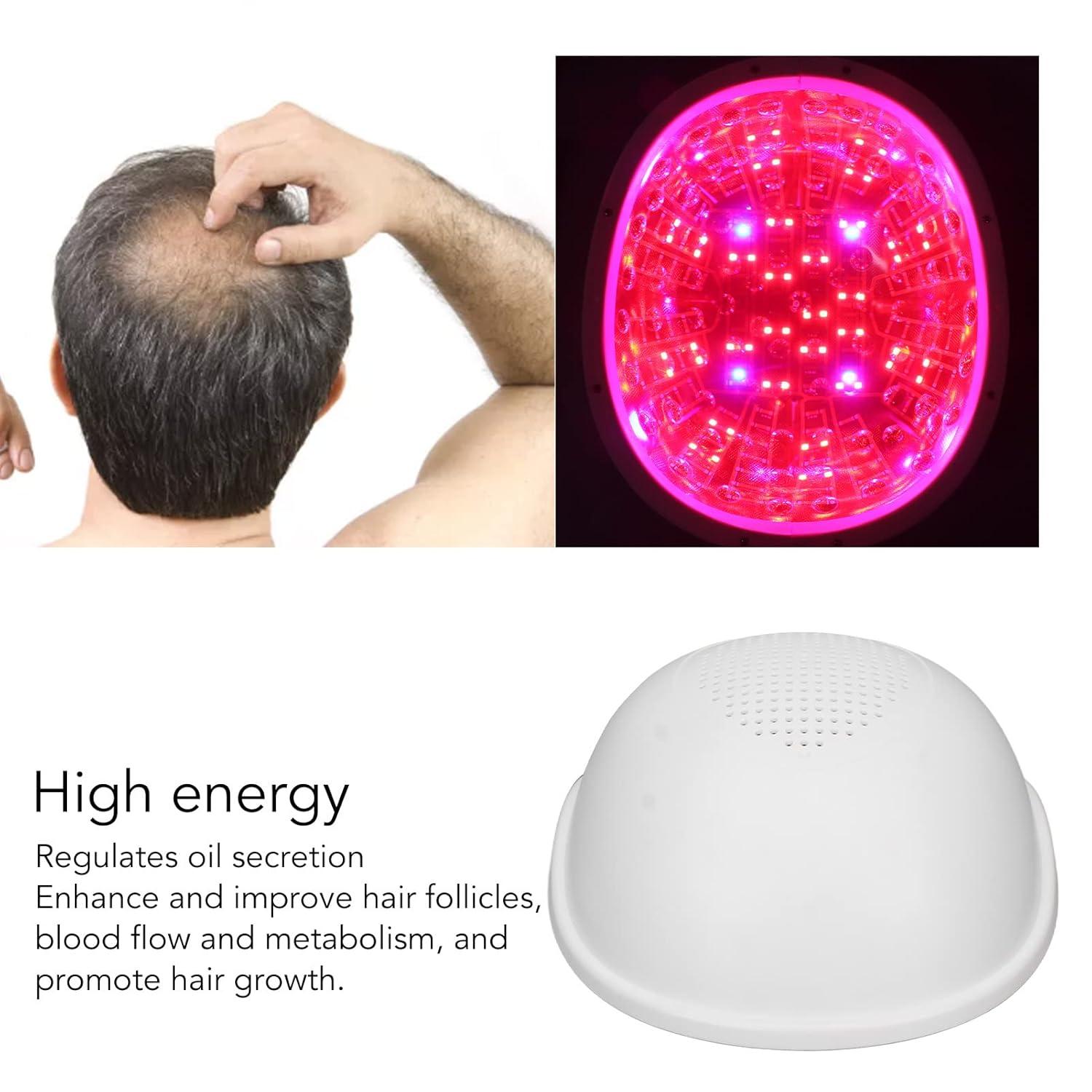 Laser Hair Growth Helmet - 62 LED Cap for Scalp Care & Hair Loss ...