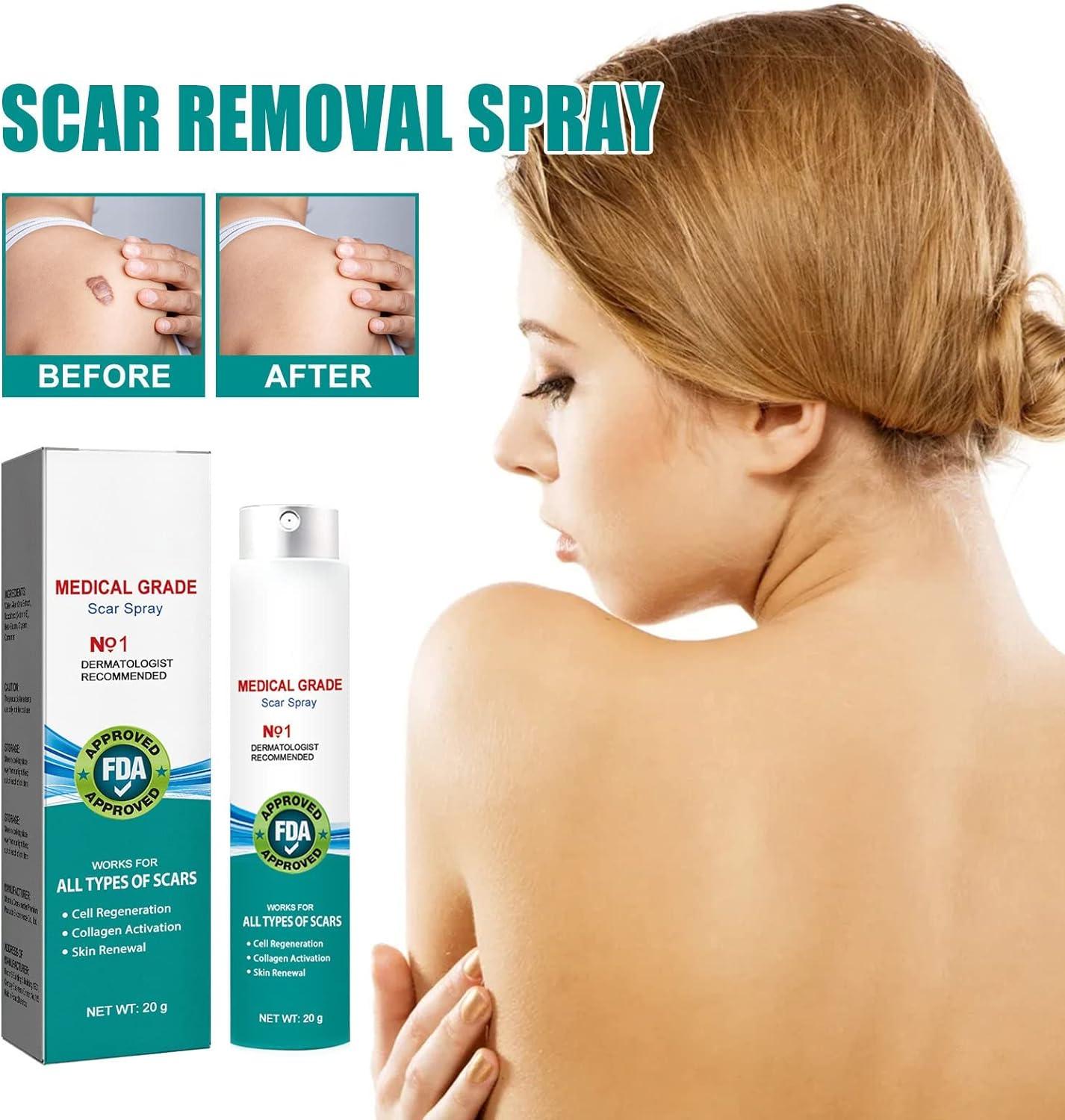 Scar Remove Advanced Spray - Acne Scar Treatment for Face, Dark Spot ...