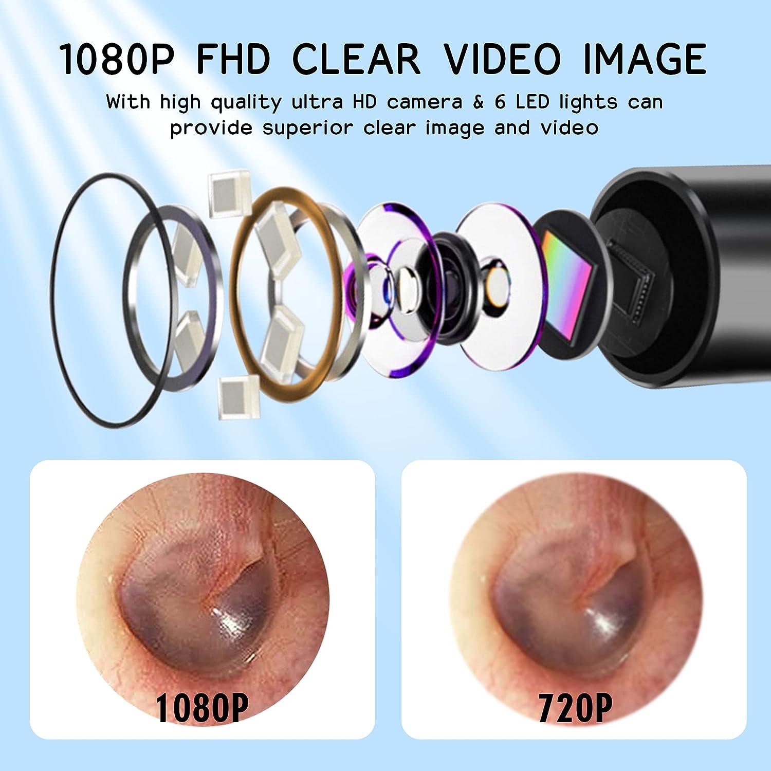 Smart Visual Ear Wax Removal Tool - 1080P FHD Wireless Otoscope with 6 ...