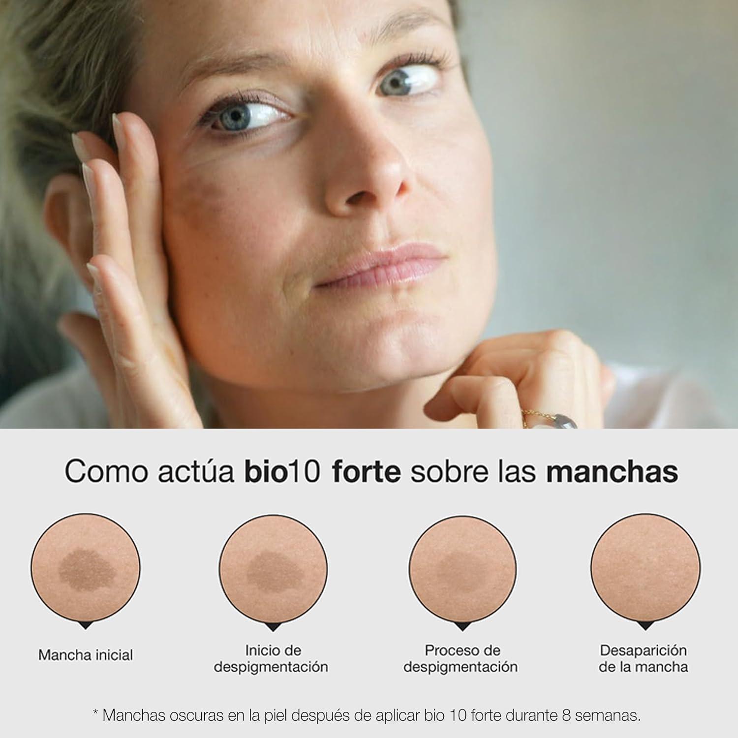 BELLA AURORA | Intensive Anti-Dark Spot Treatment | Sensitive Skin ...