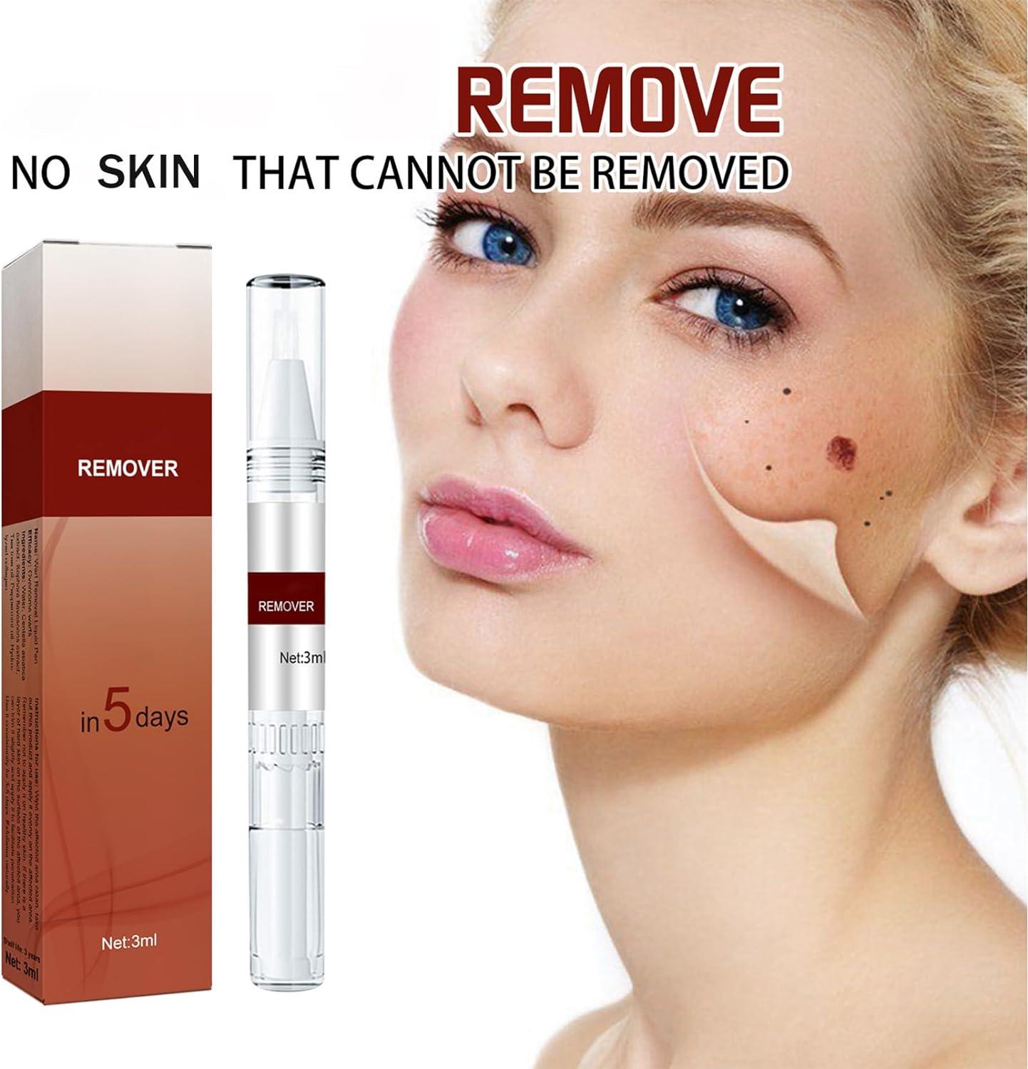 Wipe Off Remover Serum Pen | Fast & Easy 5-Day Skin Removal Solution ...