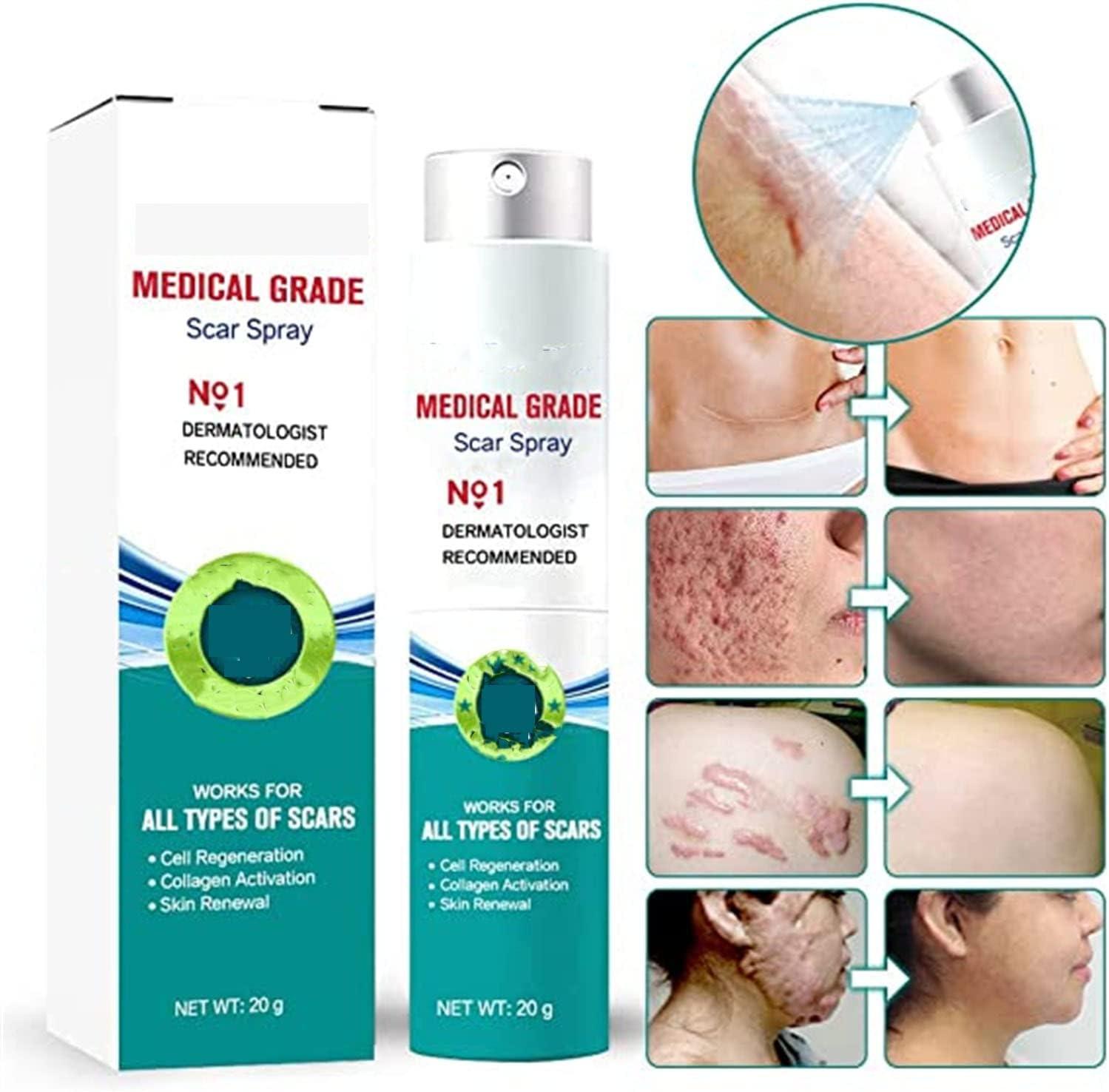 Scar Remove Medical Grade Scar Spray Scar Removal Spray Scar Remove ...
