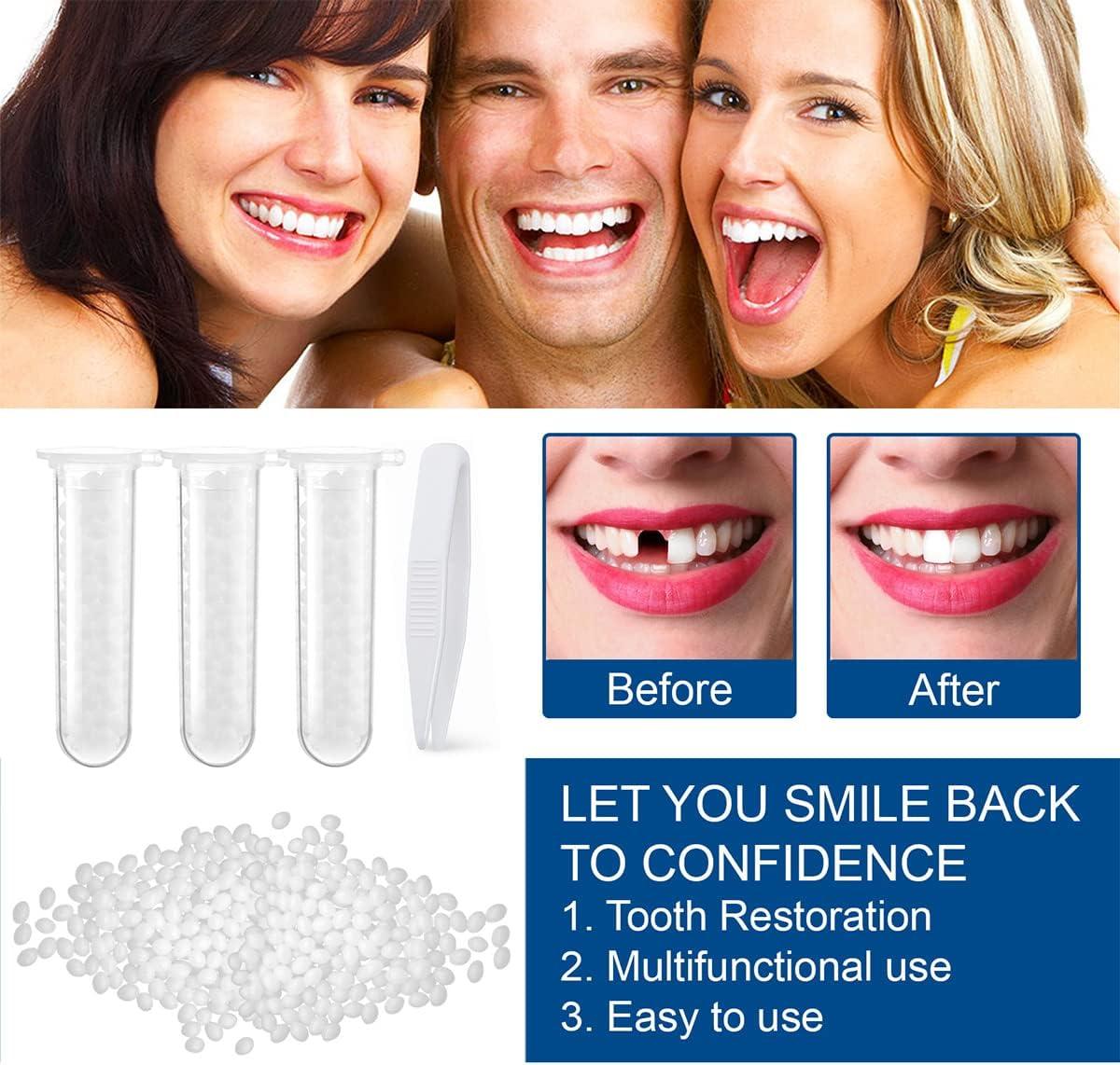 Temporary Tooth Repair Kit - Moldable Thermal Fitting Beads for Missing ...