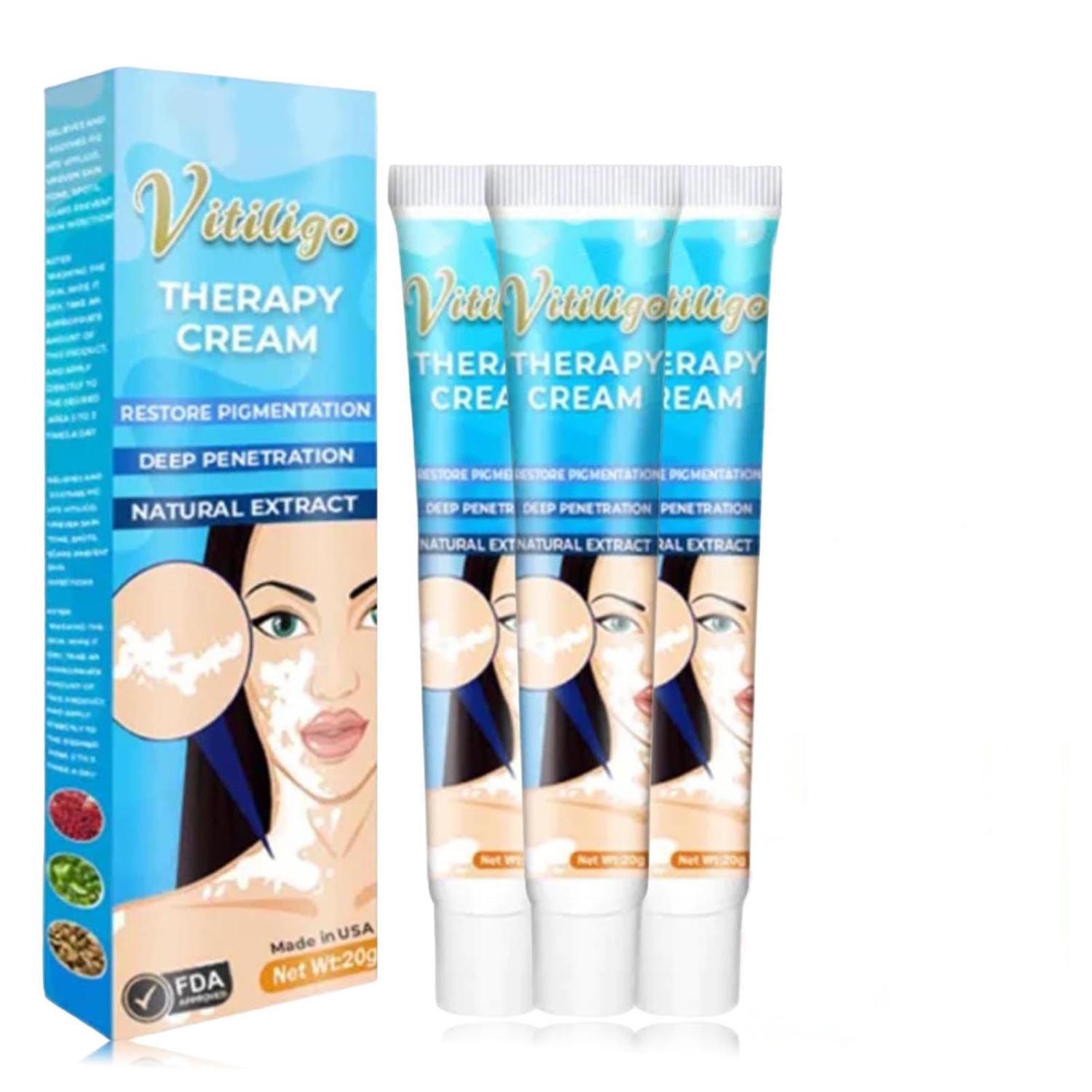 Vitiligo Cream Vitiligo Therapy Cream White Spot Cream Pigmentation ...