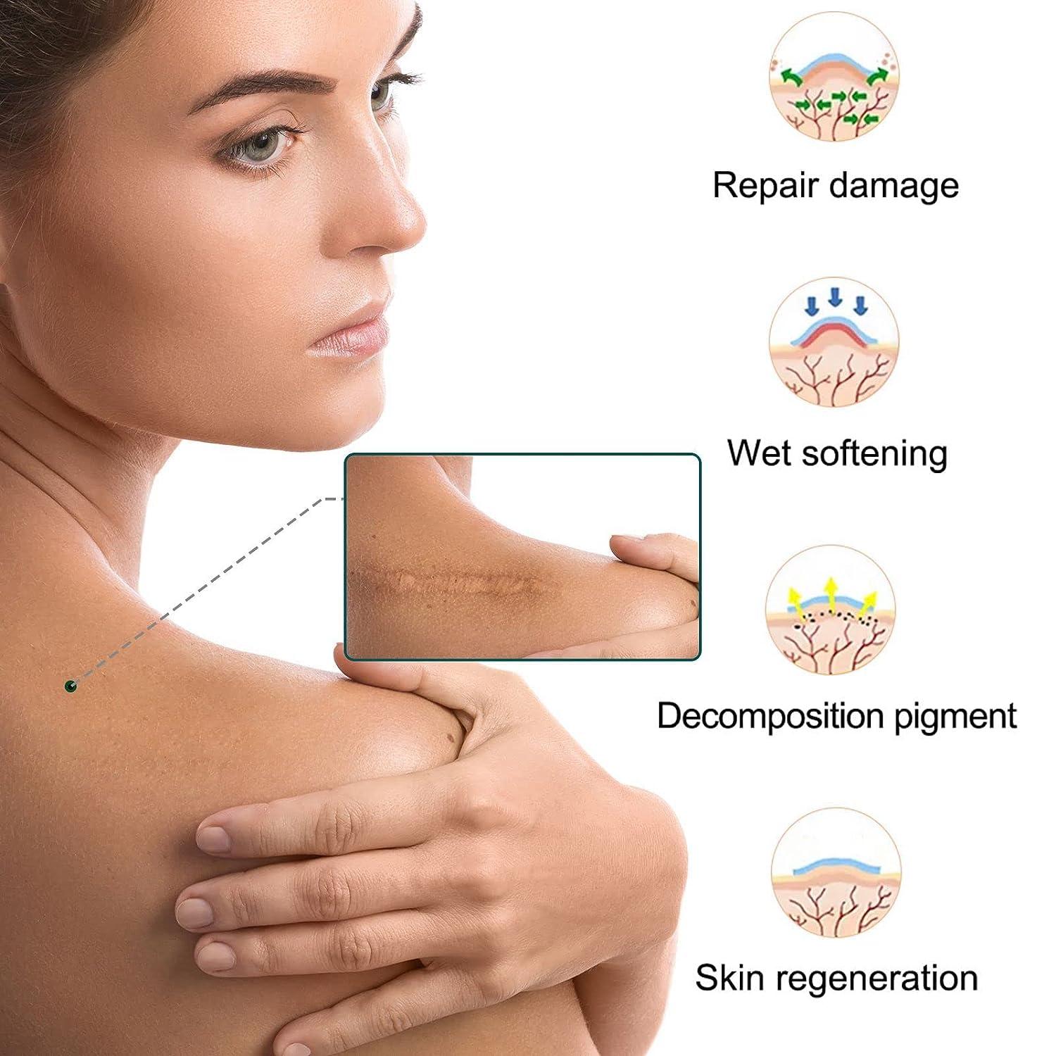 Silicone Scar Patch Roll - Professional Scar Removal Tape for Surgery ...