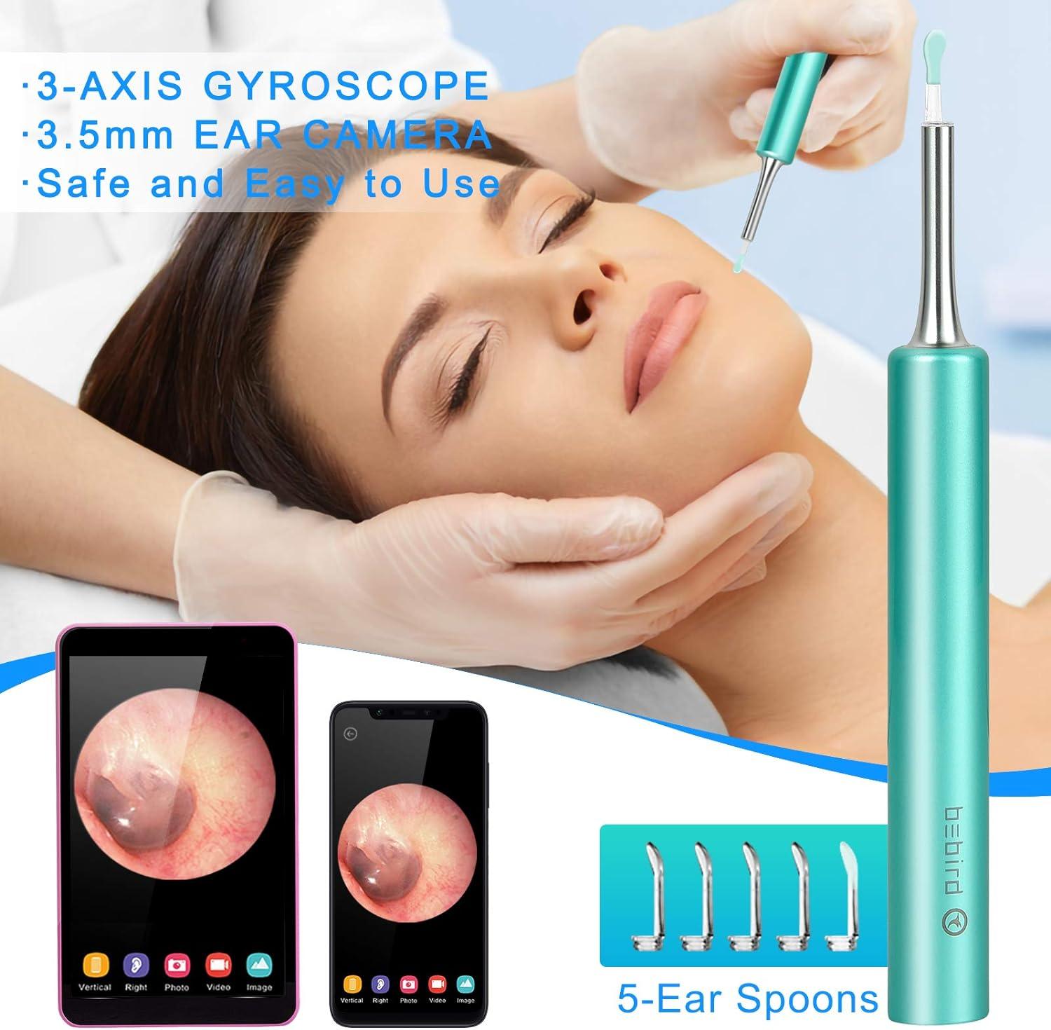Digital Ear Otoscope 3.5mm 1080P FHD Ear Camera for Ear Wax Removal ...