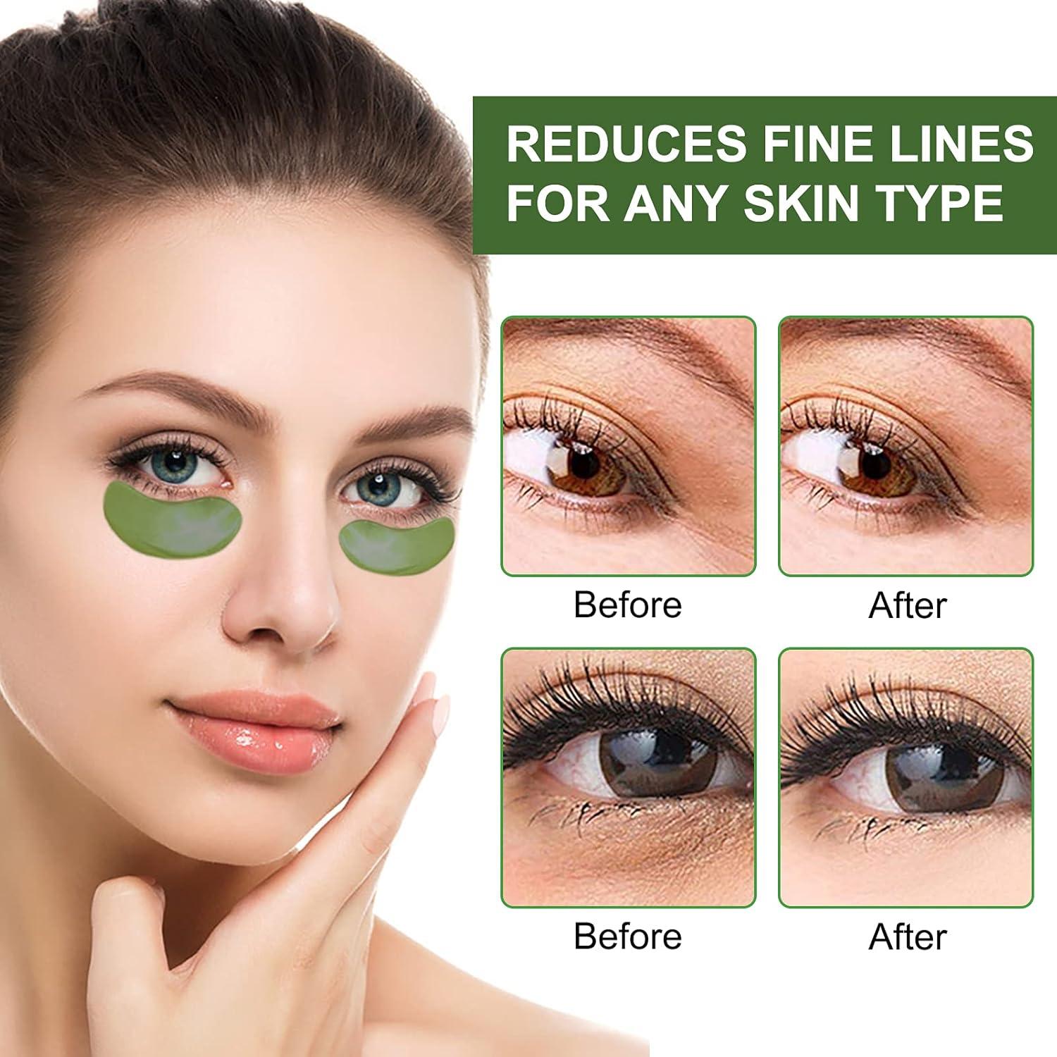 Revitalize Your Look: Eye Masks for Dark Circles Swelling & Anti-Aging ...