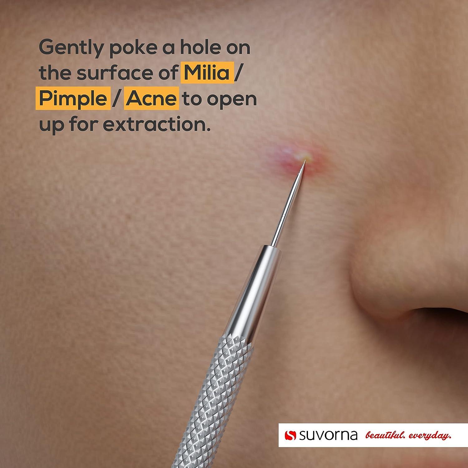 Suvorna Skinpal S35 Milia Remover Tool for Pimple, Blackhead, Whitehead ...