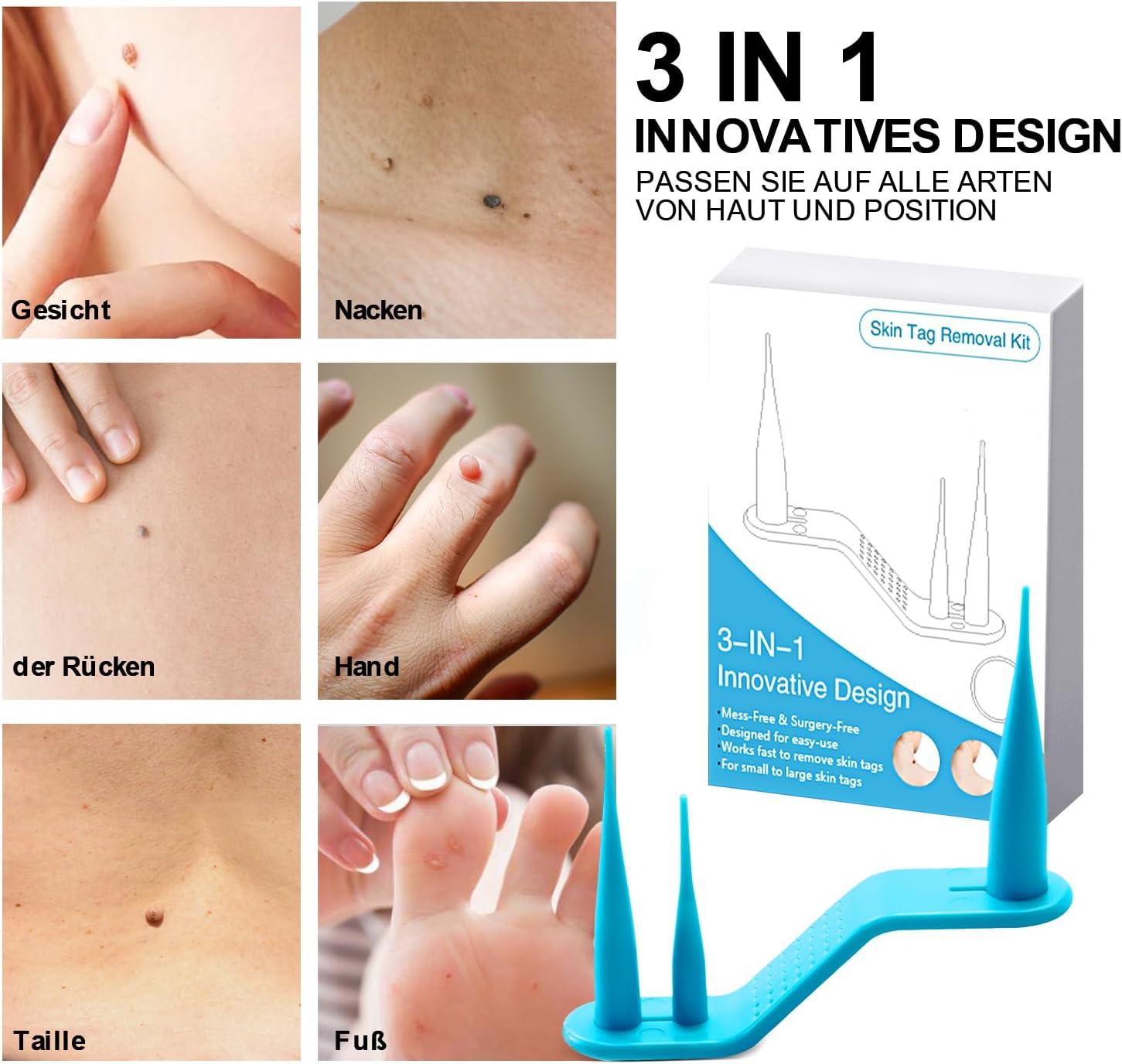 Buy Wuiil Warzenn Stem Wart Remover Kit - 3-in-1 Skin Day Patches for ...