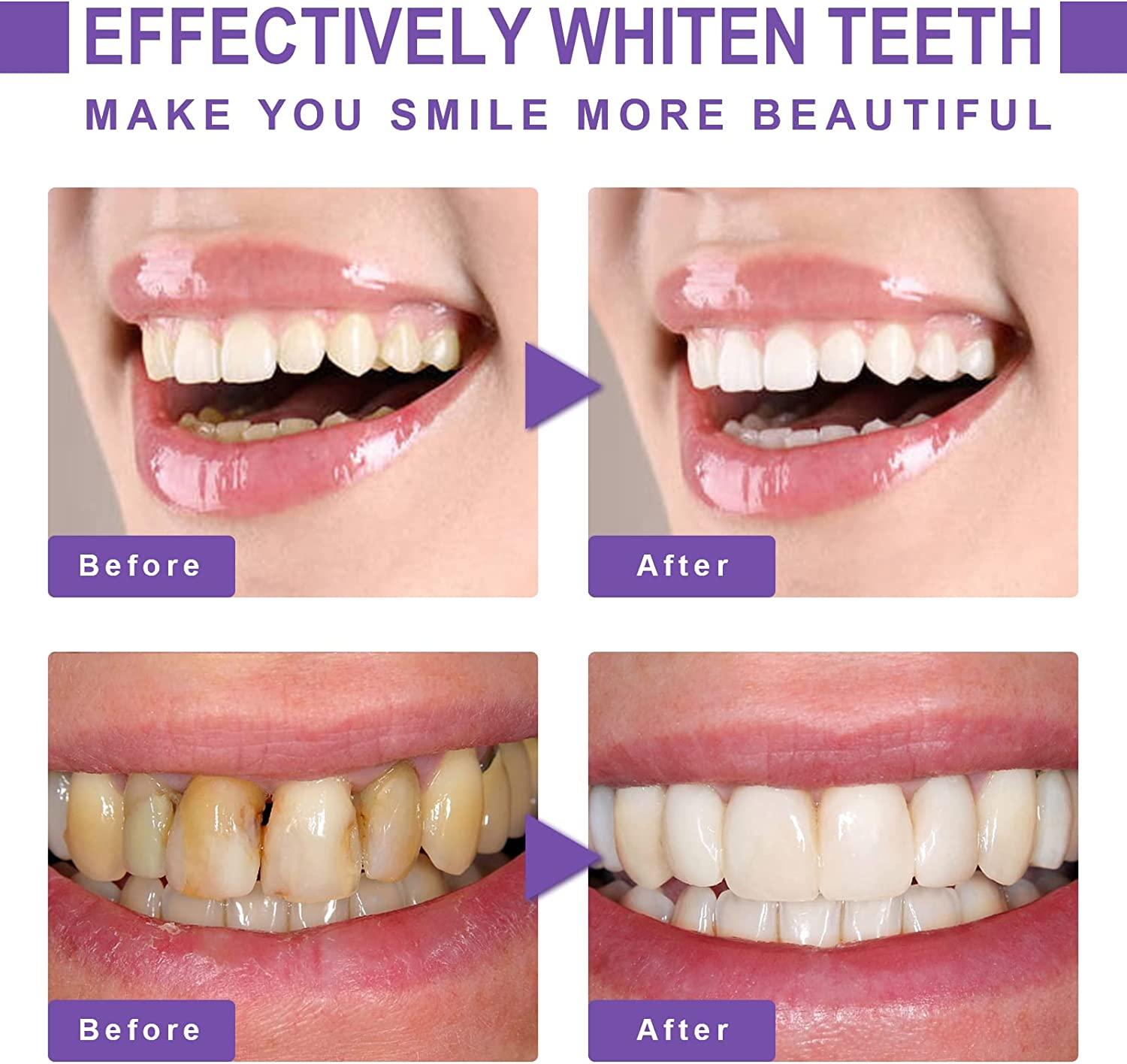 V34 Colour Corrector Teeth Whitening Toothpaste for Sensitive Teeth ...