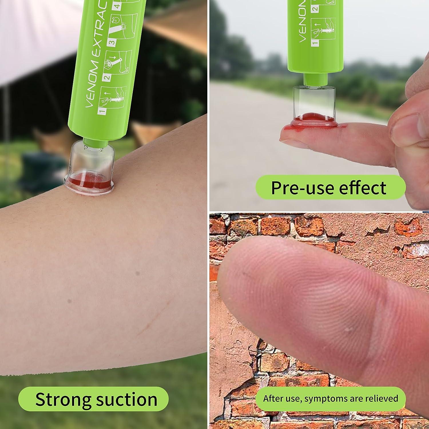 Floverkity Bug Bite Suction Tool - Venom Extractor for Fast Itch Relief ...