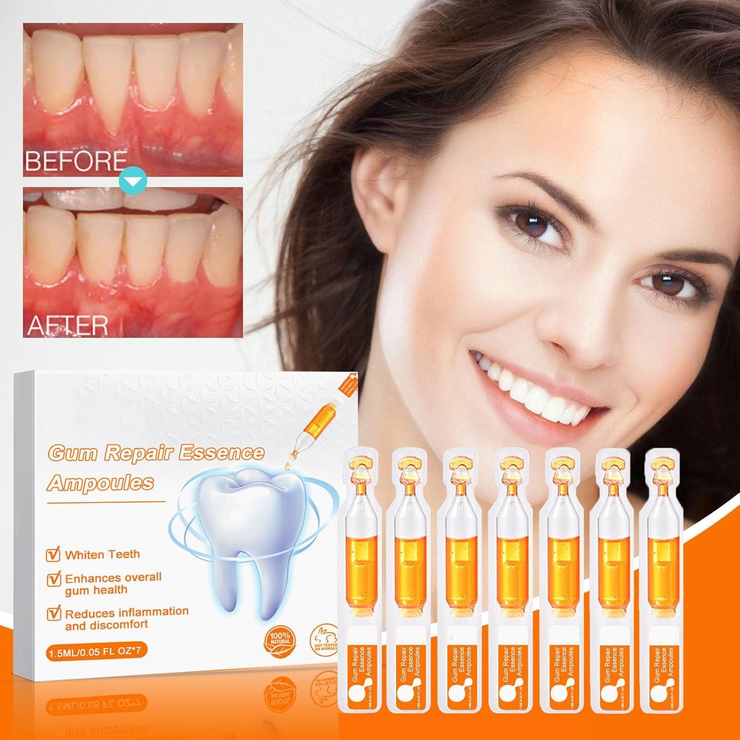 Toothpaste Toothing Meat Repair Essence Ampoules - Advanced Gum Care ...