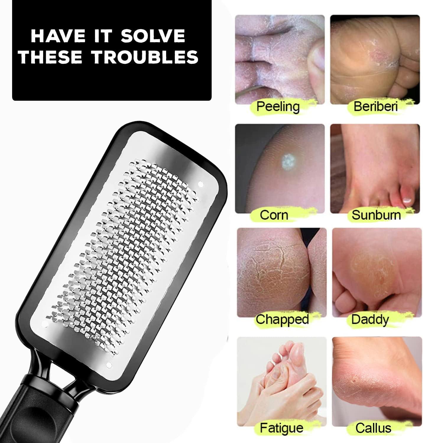 Pedicure Foot File for Hard Skin Removal | Metal Surface Dead Skin ...
