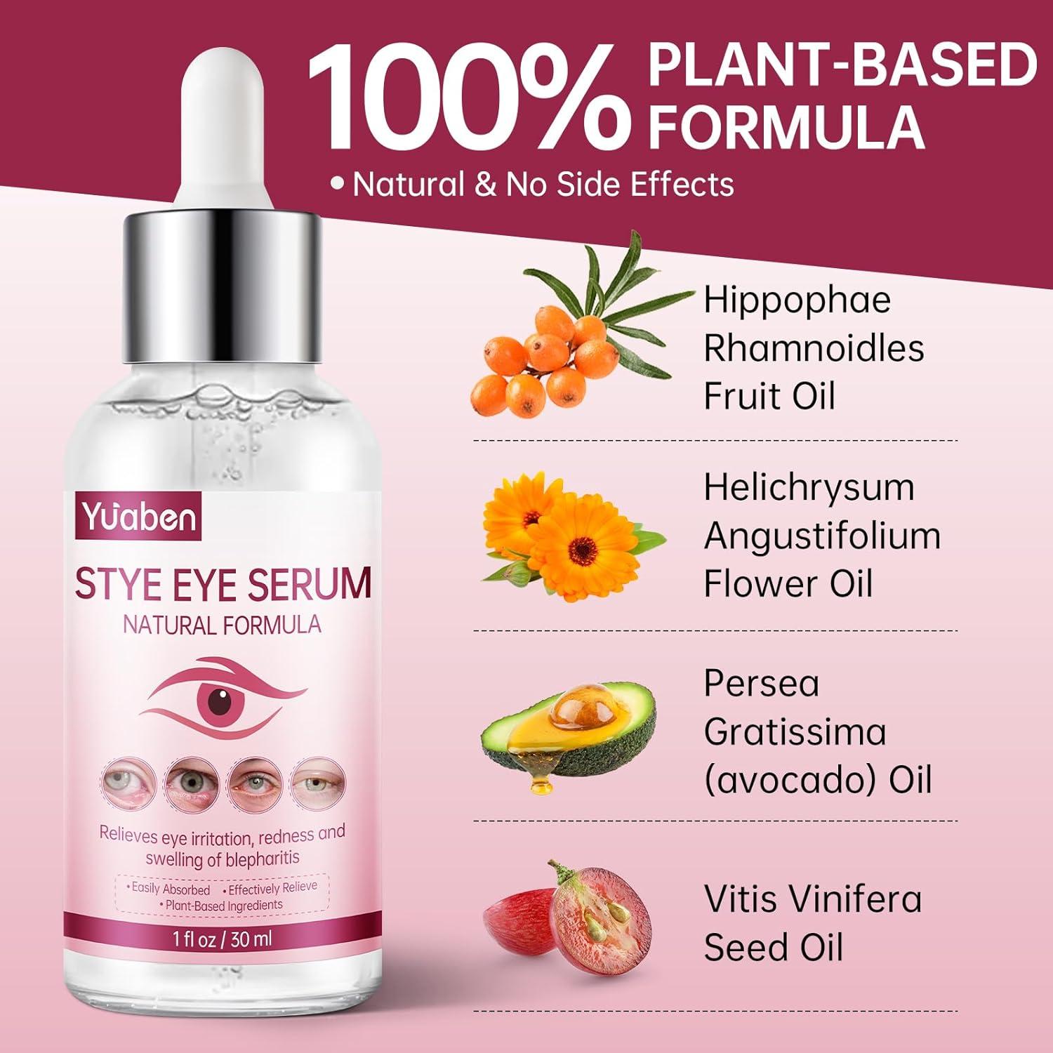 Stye Eye Treatment - Fast Relief Drops for Styes Chalazion ...