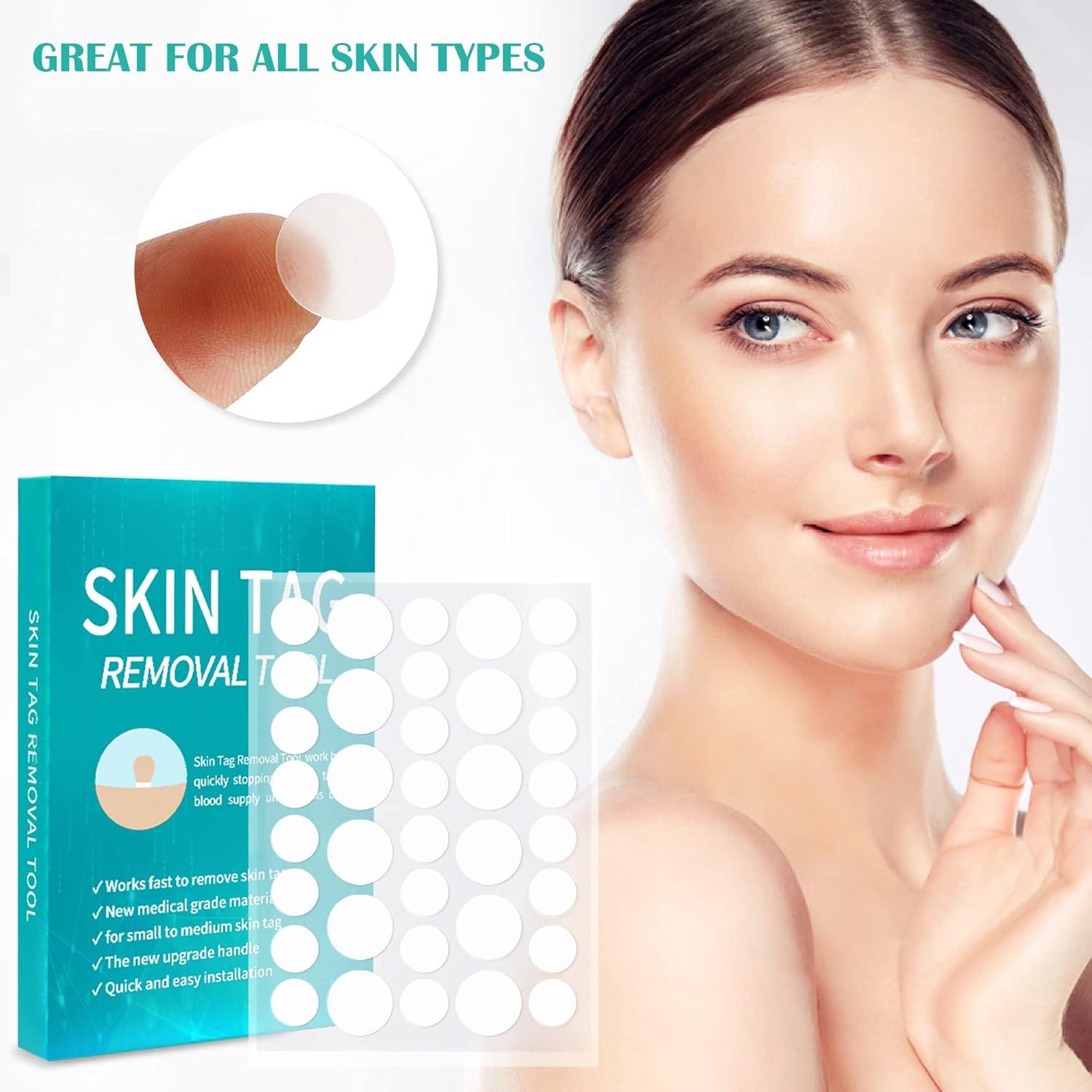 Skin Day Distant Micro Skin Tag Removal Kit - Efficiently Remove Small ...