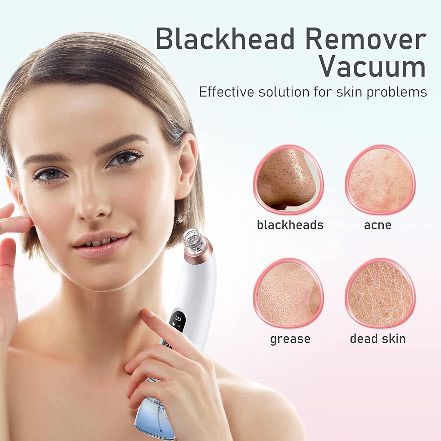 Blackhead Remover Pore Vacuum With Usb Interface Pore Cleaner For Men