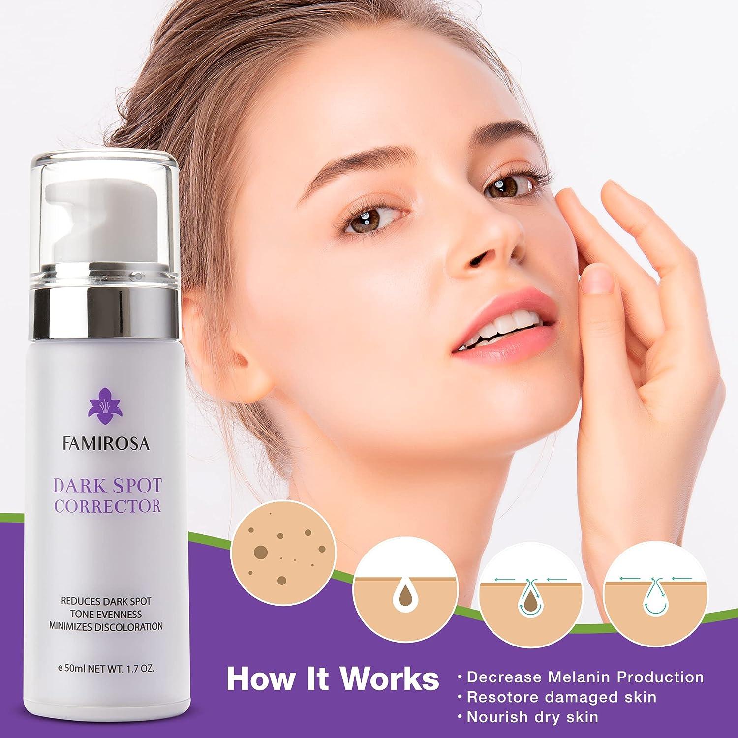 Dark Spot Remover for Face and Body - Melasma & Freckle Corrector - Hyperpigmentation Treatment ...